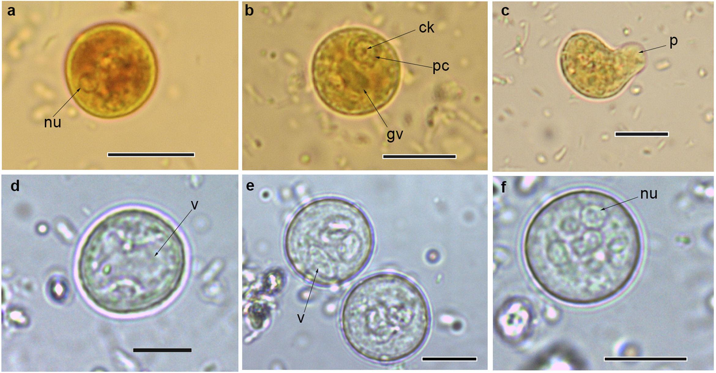 Entamoeba Coli Cysts And Trophozoites