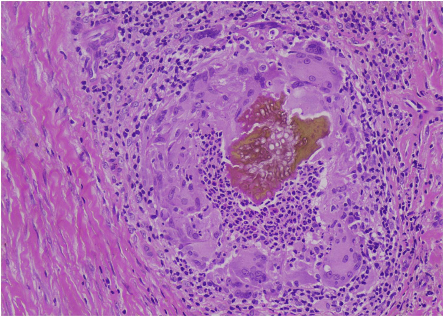 Clinical and epidemiological profile of mycetoma patients from a ...