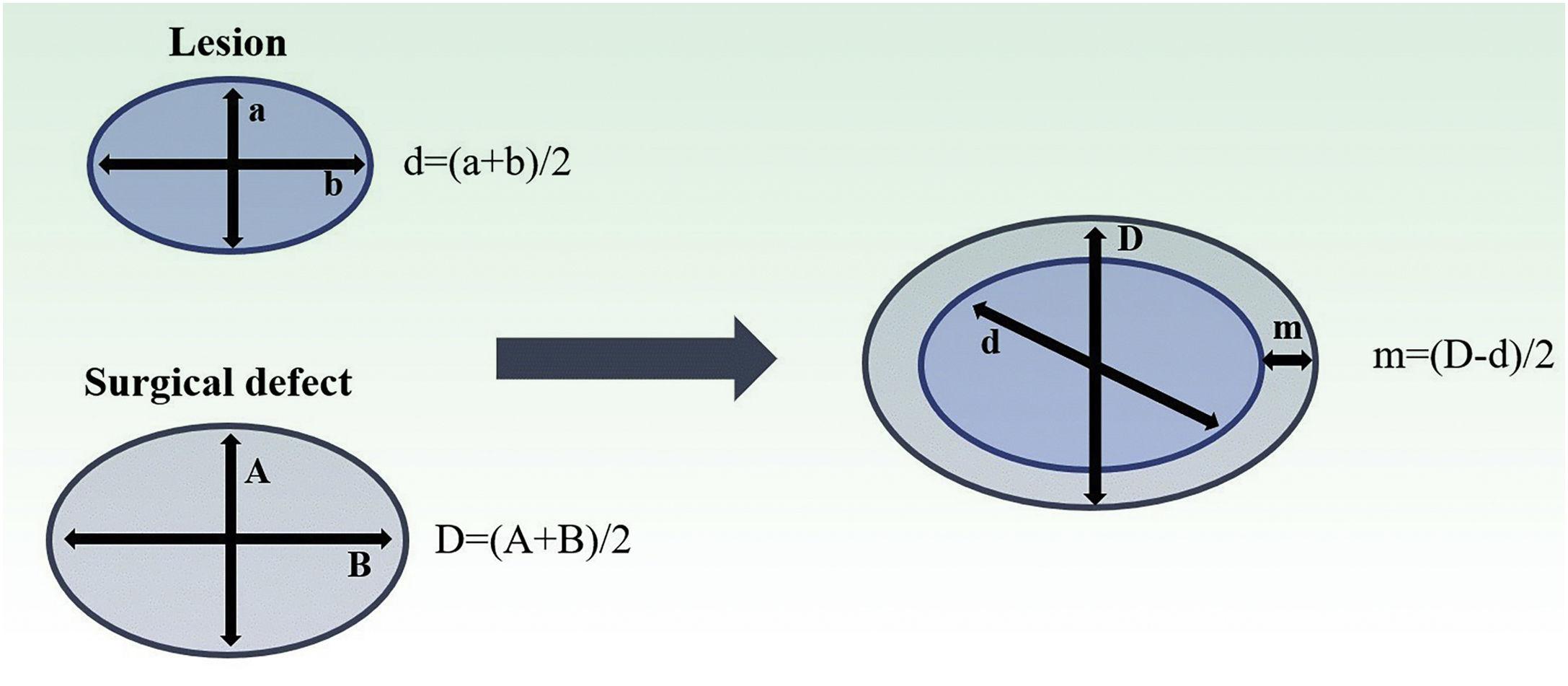 Clinicopathological factors influencing the number of stages of Mohs ...
