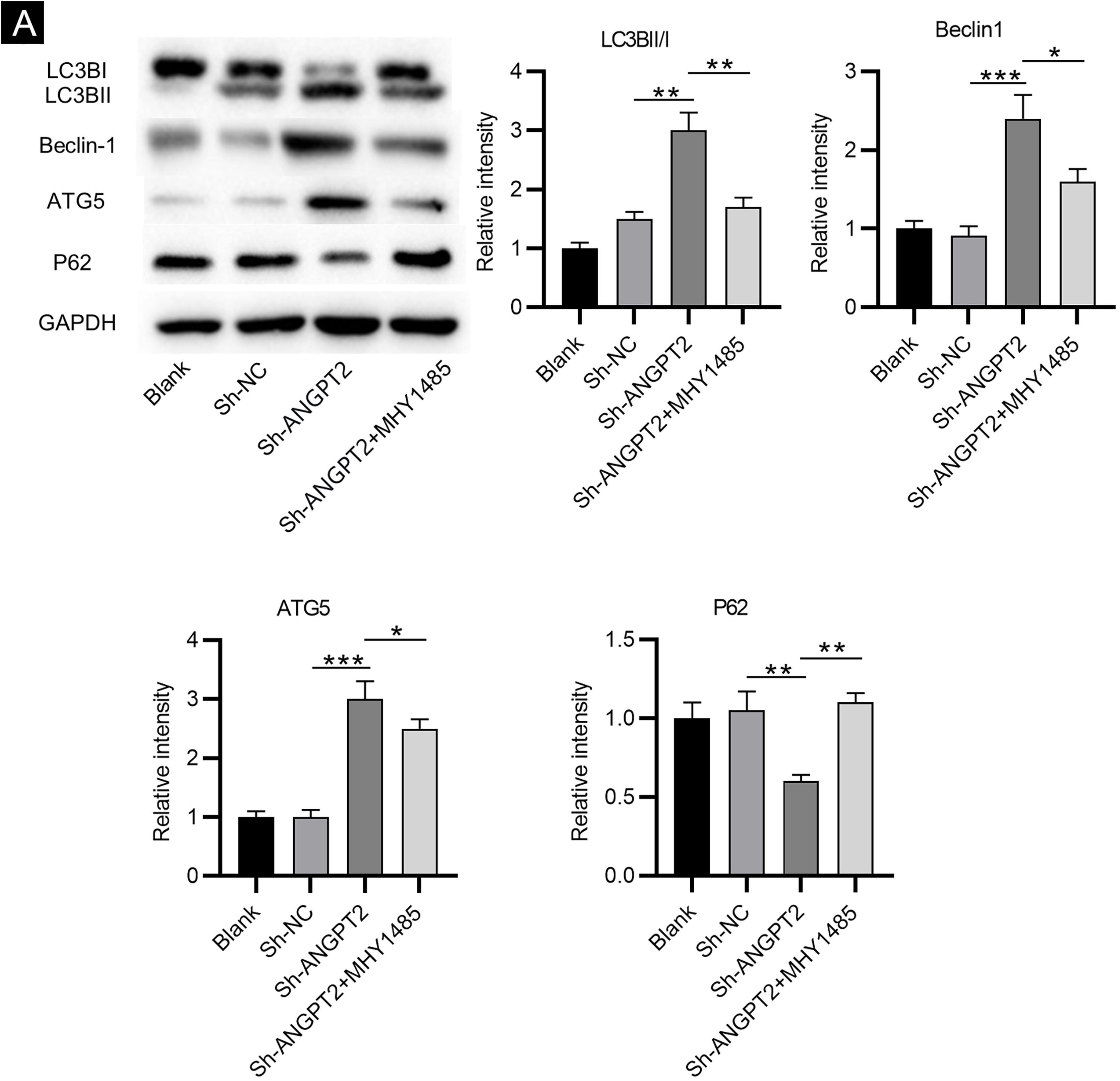 Inhibition of ANGPT2 activates autophagy during hypertrophic scar ...