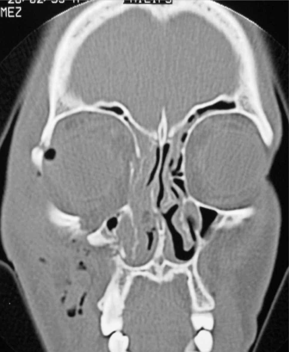 Manejo del trauma facial: Una guía práctica | Revista Médica Clínica ...