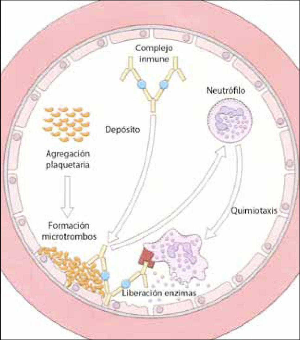 Mecanismos de daño inmunológico | Revista Médica Clínica Las Condes