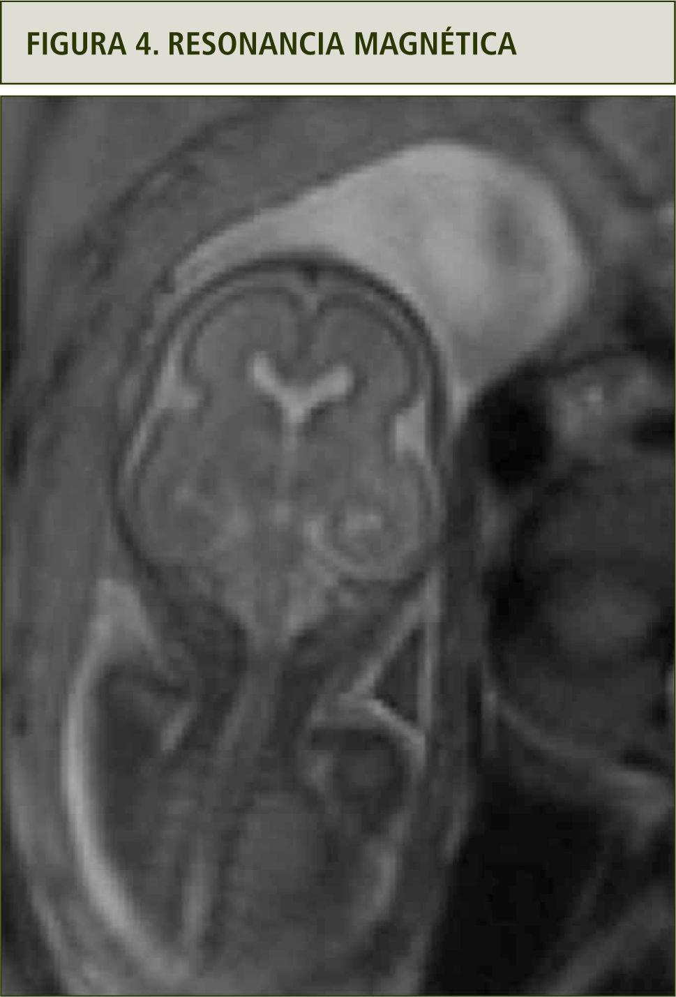 Diagnóstico prenatal: Casos clínicos | Revista Médica Clínica Las Condes