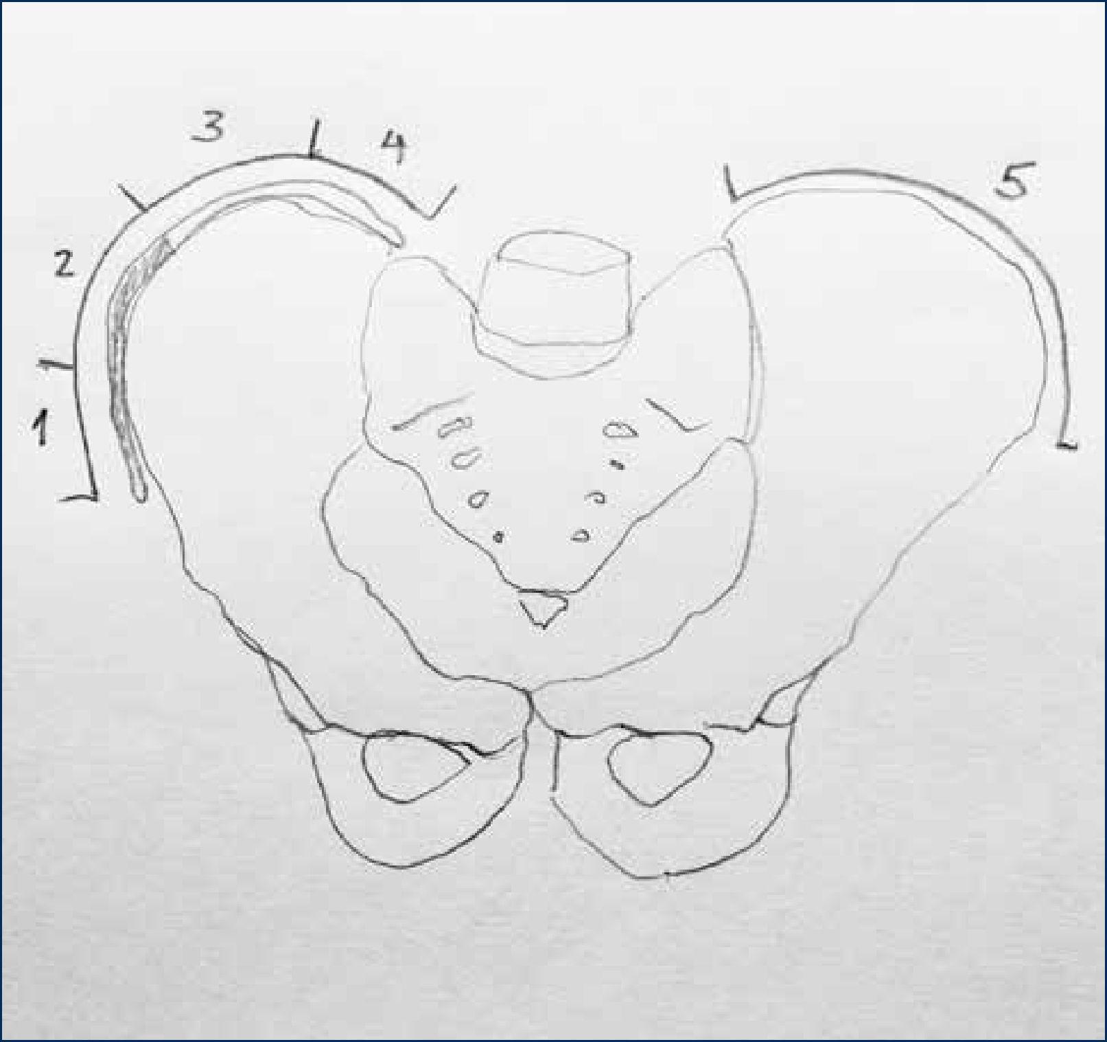 Escoliosis en niños y adolescentes | Revista Médica Clínica Las Condes
