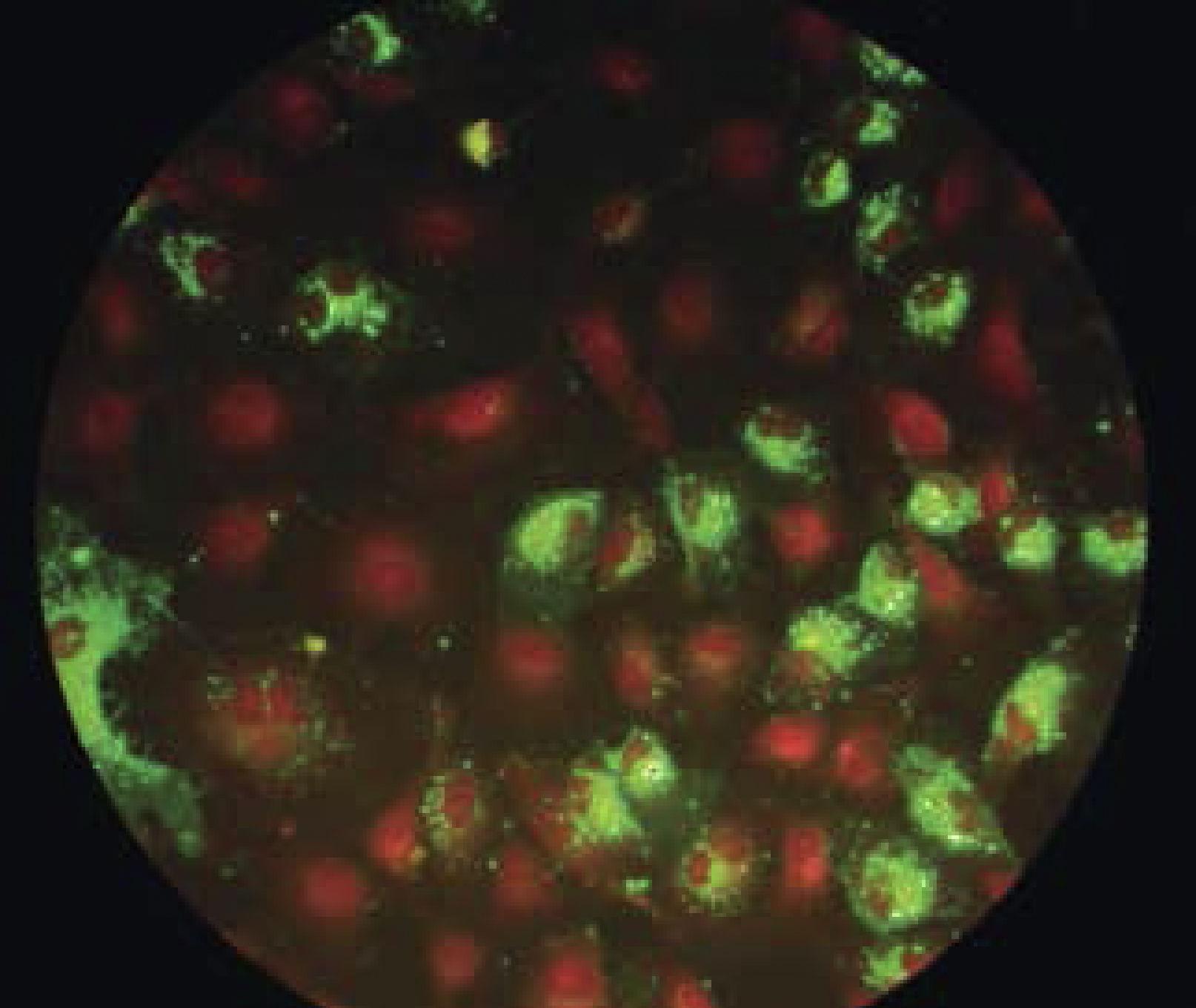 LABORATORIO DE VIROLOGÍA EN LA PRÁCTICA CLÍNICA | Revista Médica ...