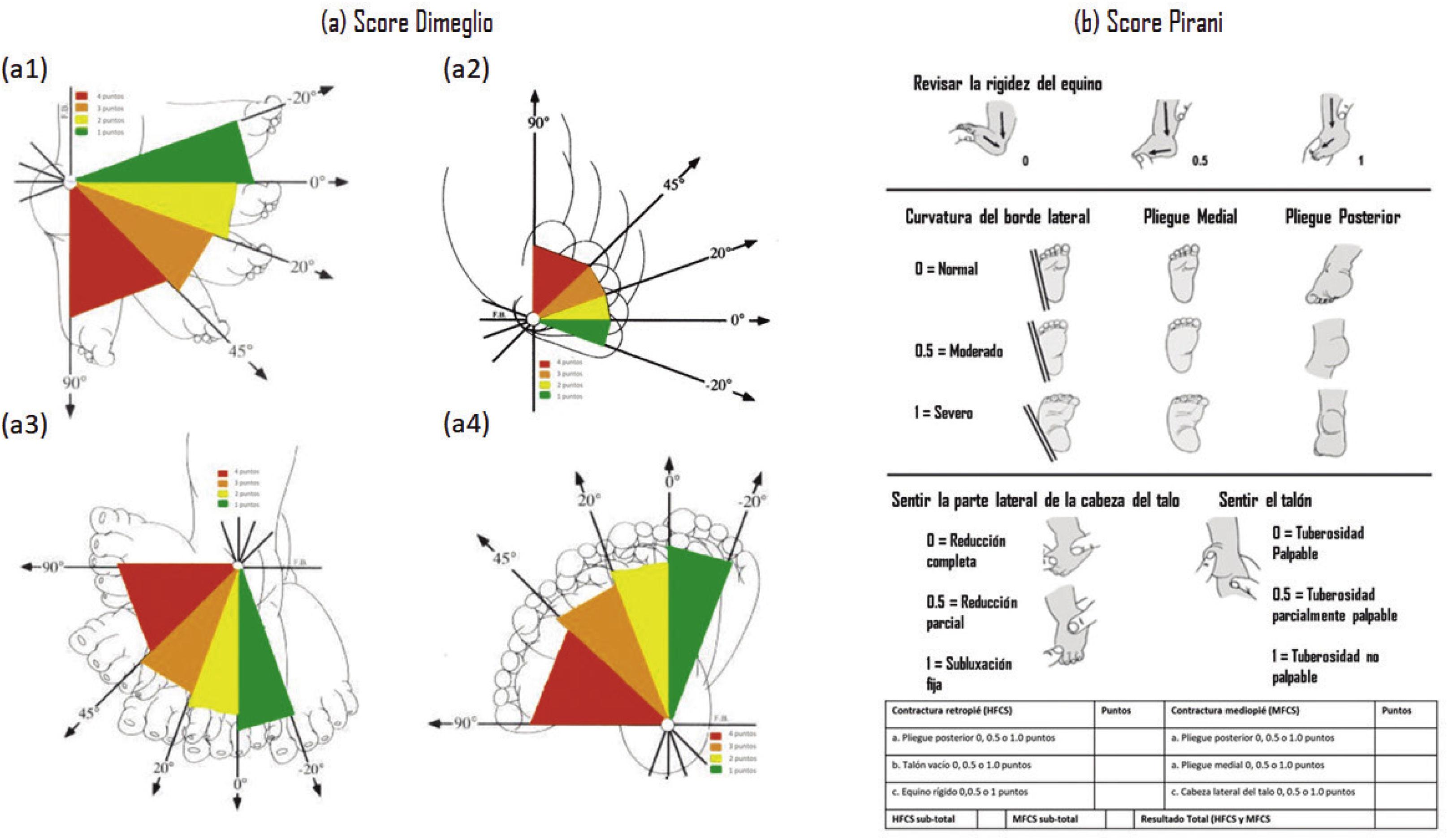 PIE BOT: CONCEPTOS ACTUALES | Revista Médica Clínica Las Condes