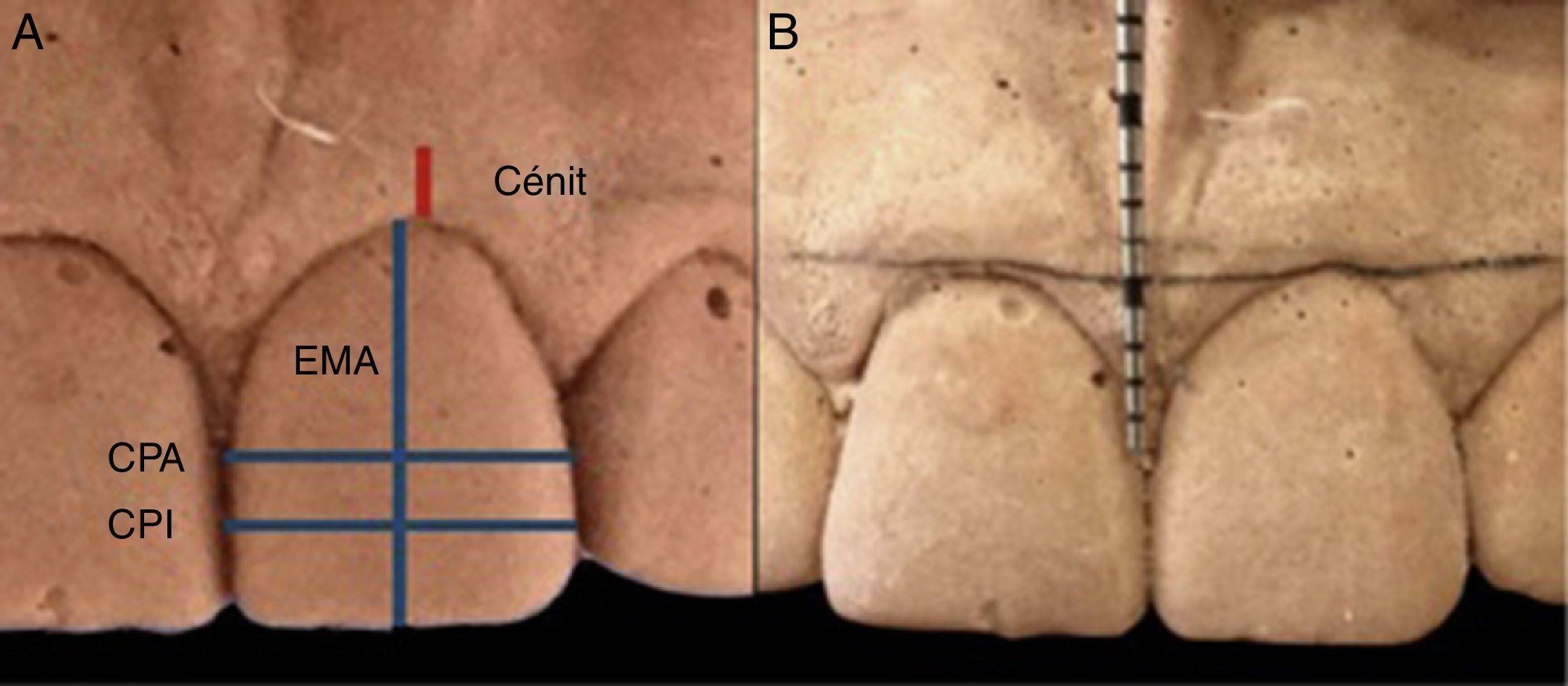 Parámetros mucogingivales y dentarios en estudiantes de odontología ...