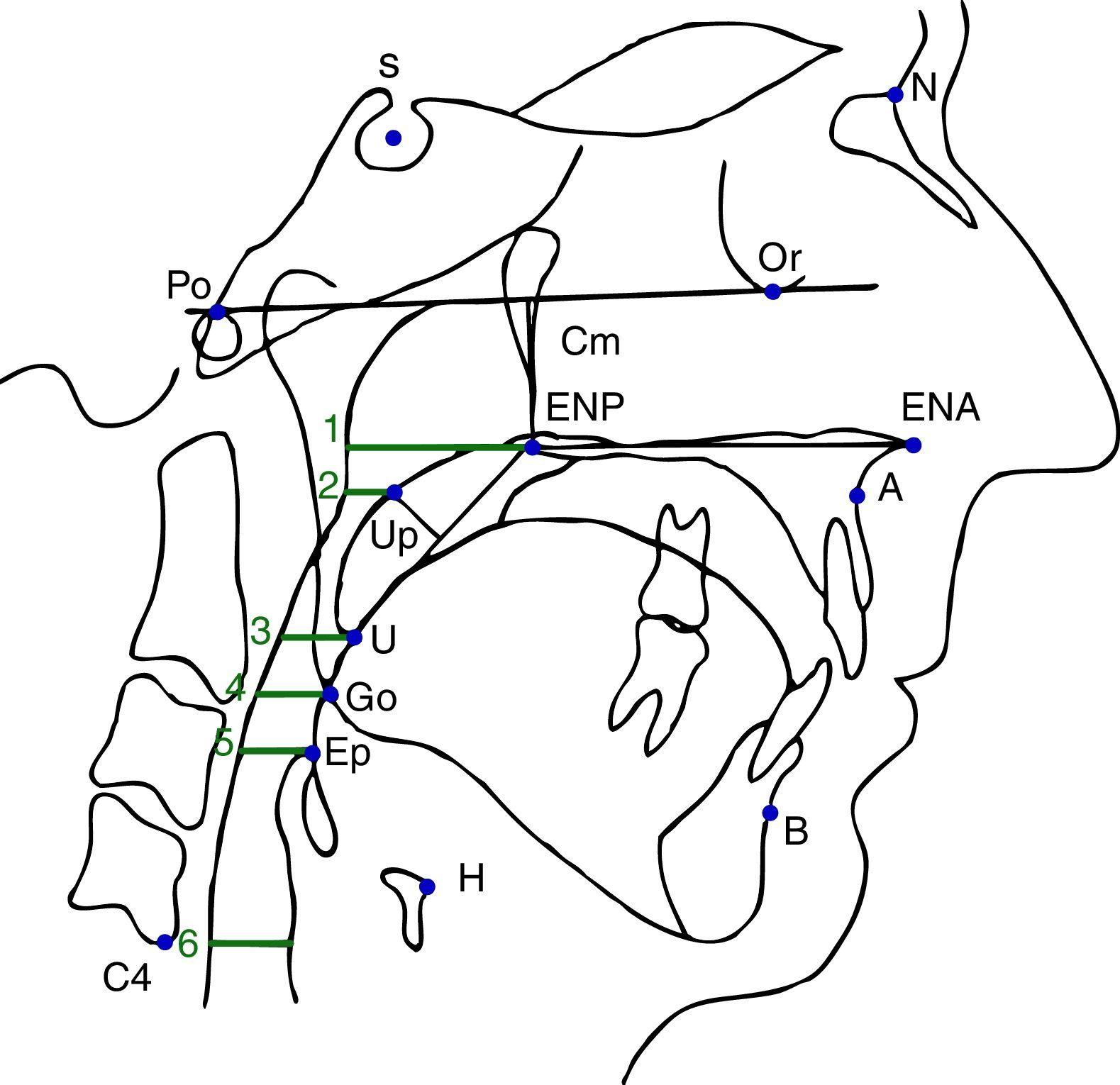 Efecto de los dispositivos oclusales sobre la vía aérea en pacientes ...