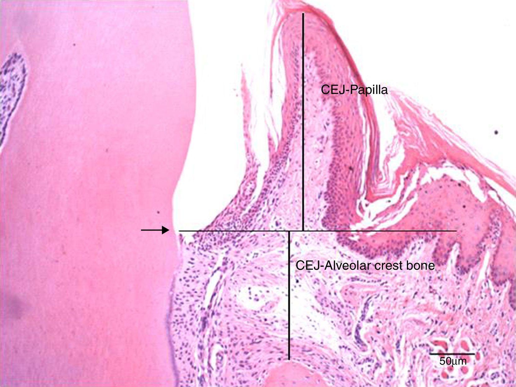 Mucogingival Junction Histology
