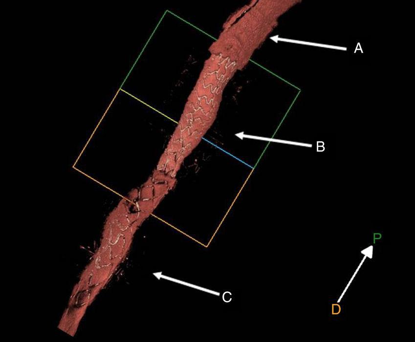 Optical coherence tomography images of three different overlapping ...