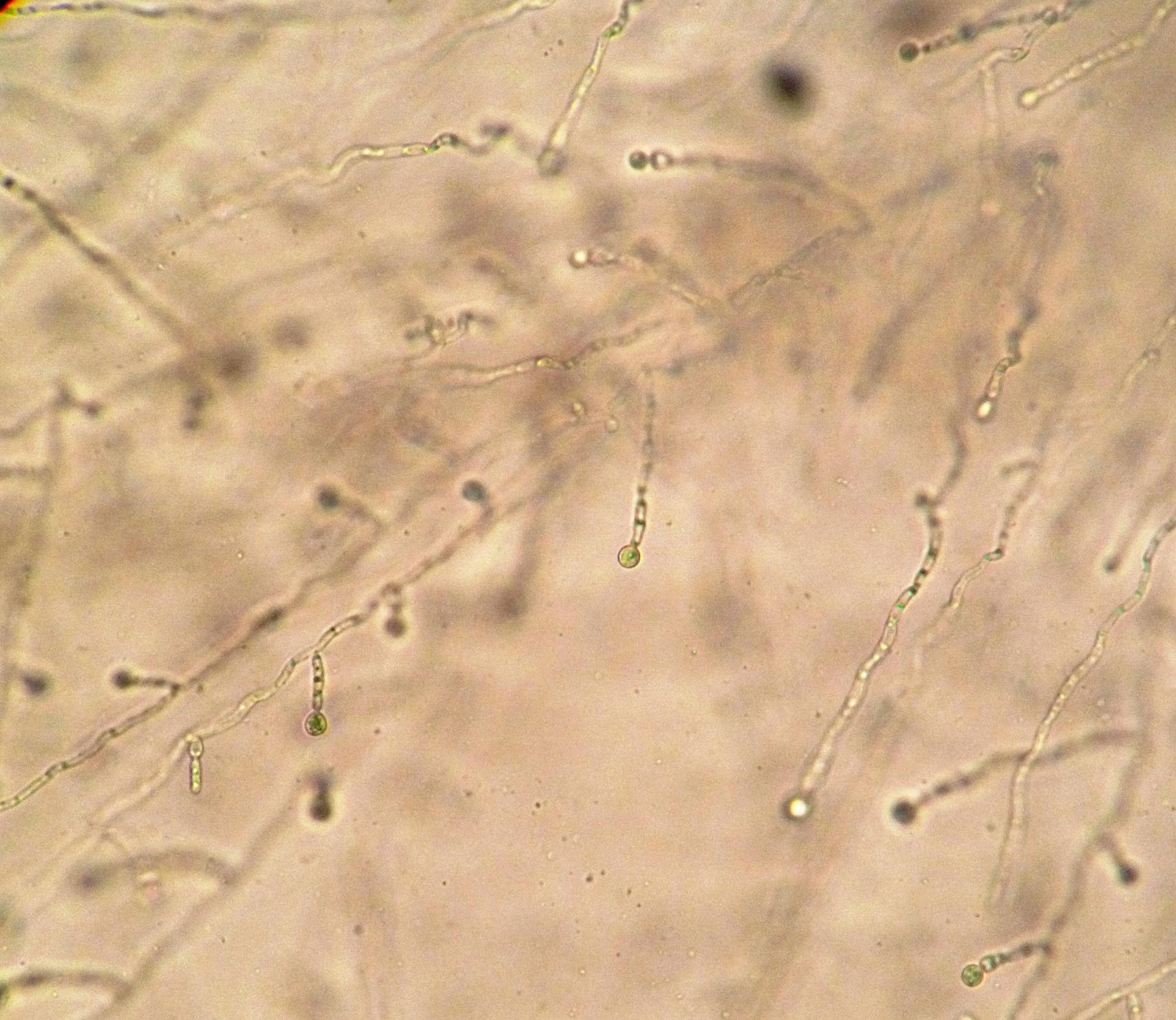 Problemas clínicos en micología médica: problema número 49 | Revista ...