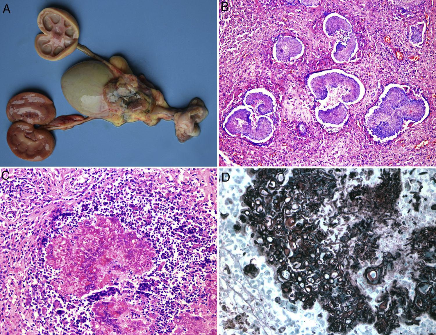 Intra-abdominal fungal pseudomycetoma in two cats | Revista ...