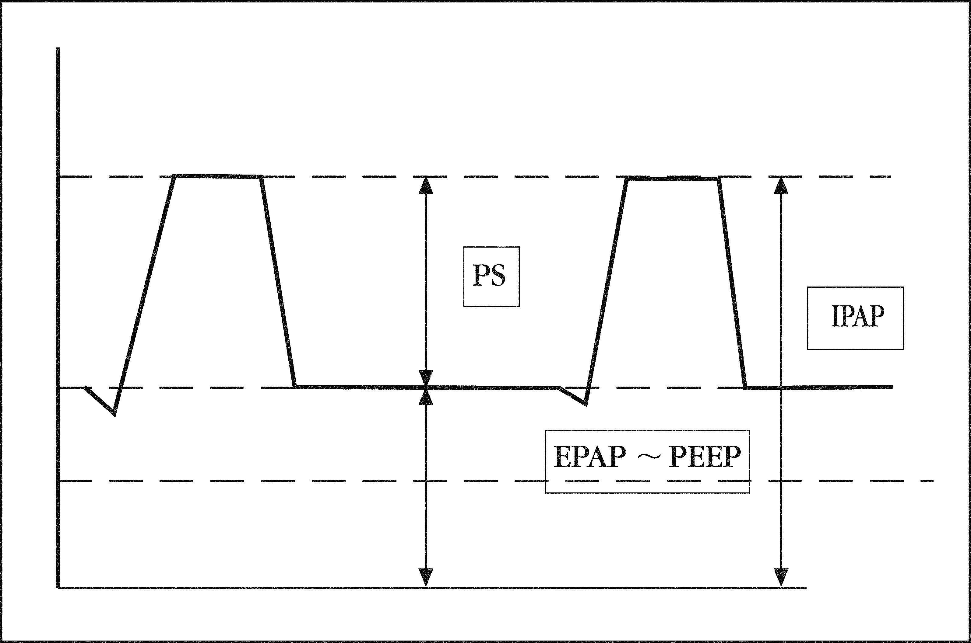 Metodología en ventilación no invasiva | Enfermería Intensiva