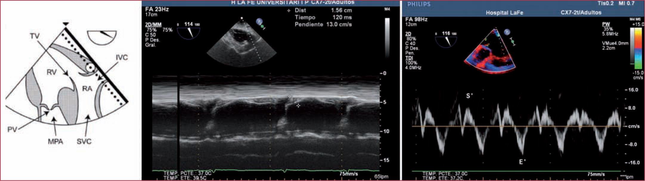 Herramientas diagnósticas para la monitorización intraoperatoria de la ...