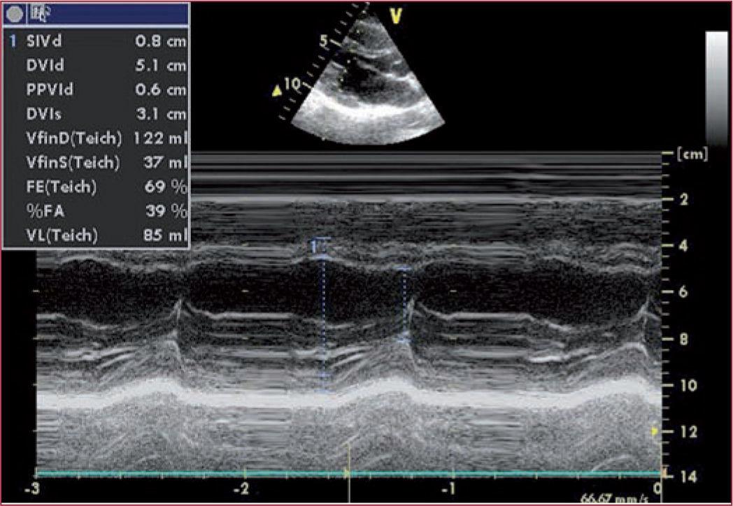 Técnicas de imagen no invasivas en la investigación cardiovascular ...