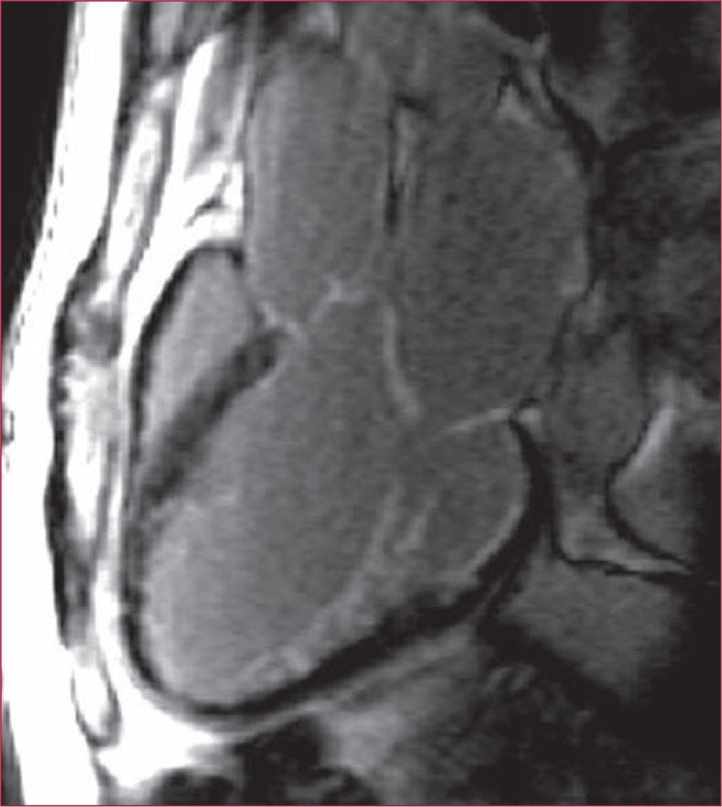 Técnicas de imagen no invasivas en la investigación cardiovascular ...