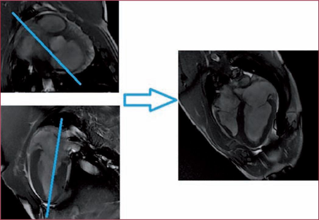 Resonancia magnética cardiaca en modelos animales | Revista Española de Cardiología
