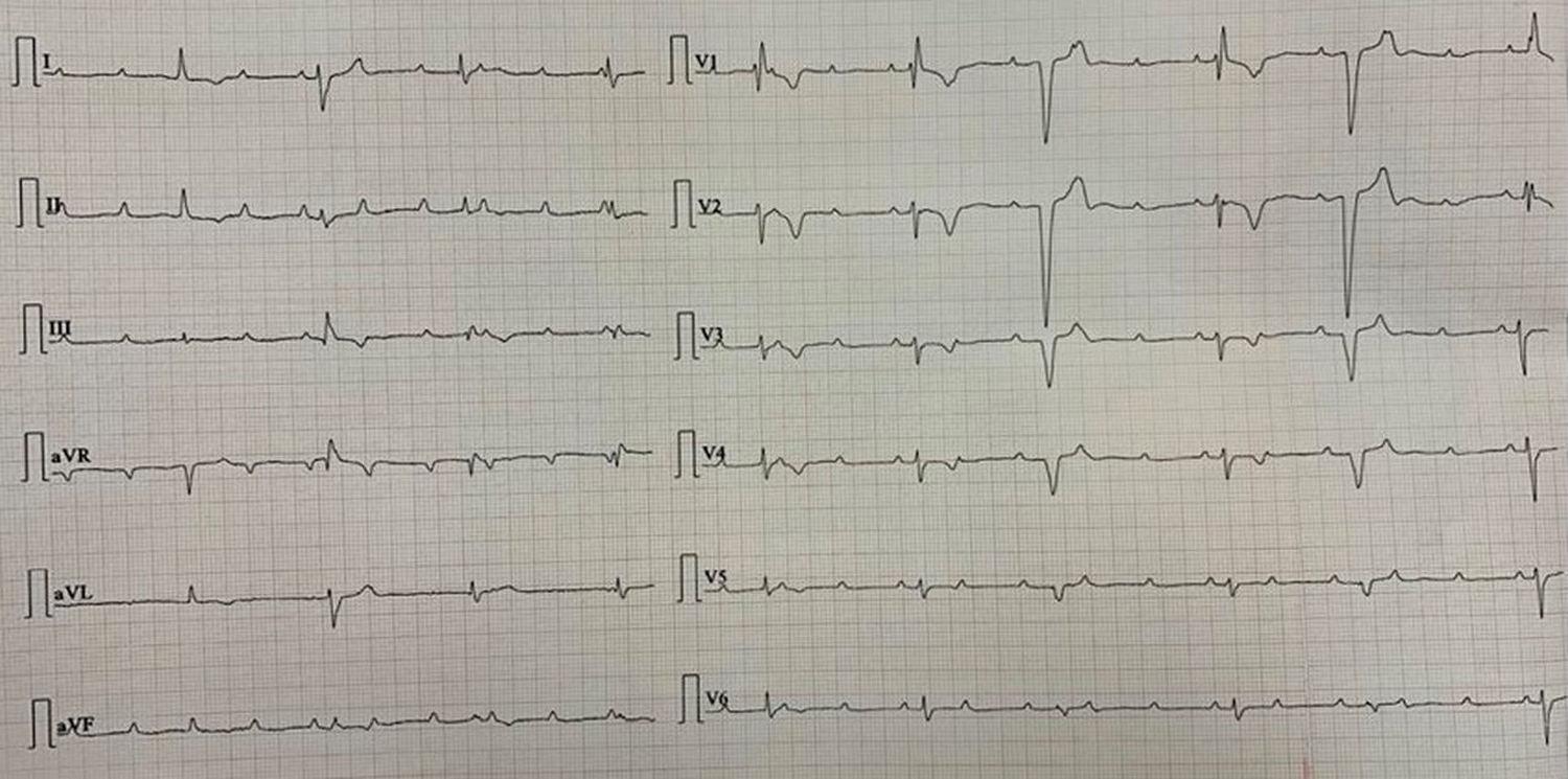 Epidemiological, demographic, laboratory, clinical management, and ...