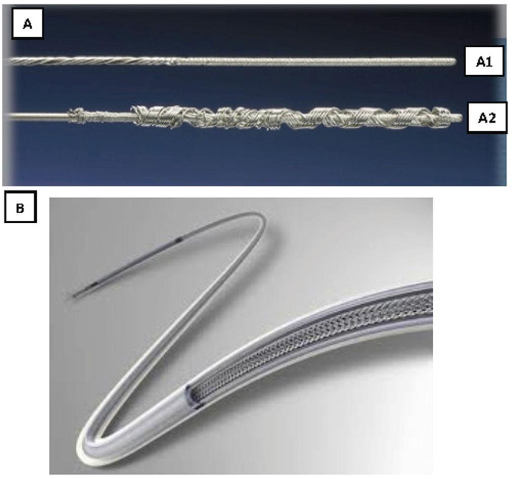 Extracción percutánea con vainas mecánicas en las infecciones de ...