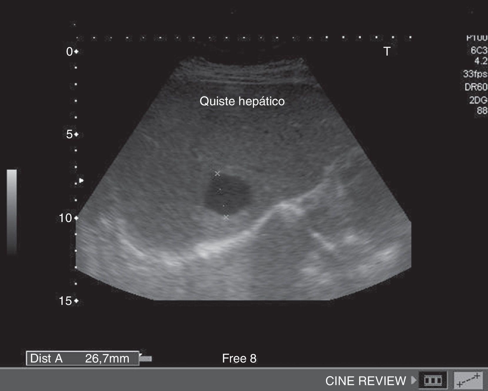 La importancia de la ecografía en atención primaria | Medicina de ...
