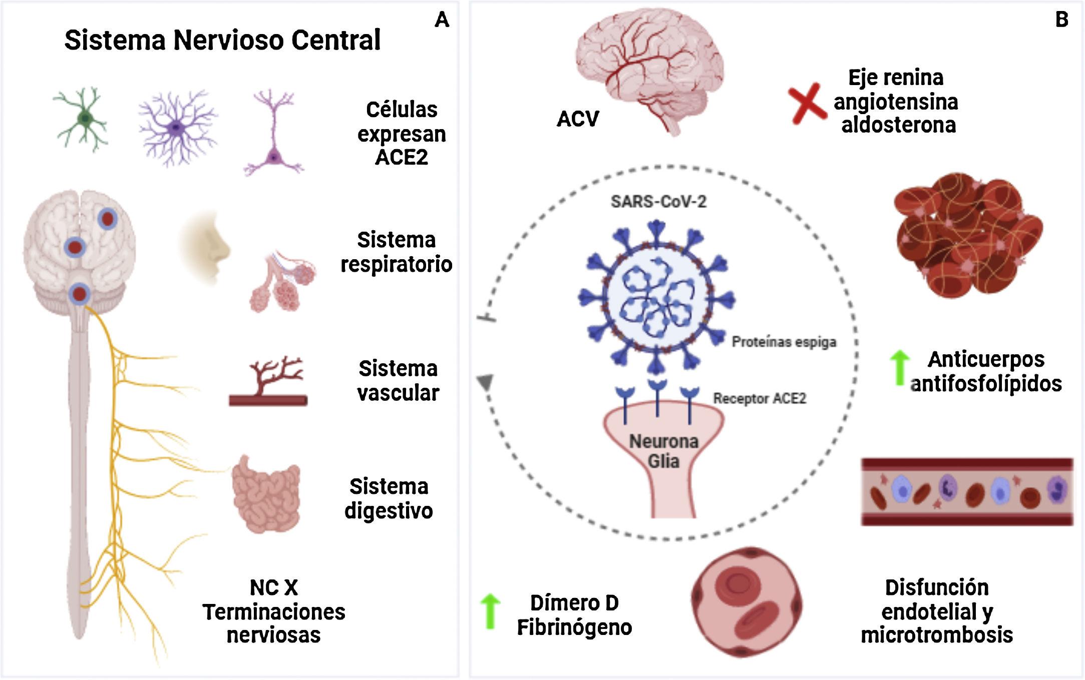 Infección por SARS-CoV-2 y ataque cerebrovascular isquémico | Medicina ...