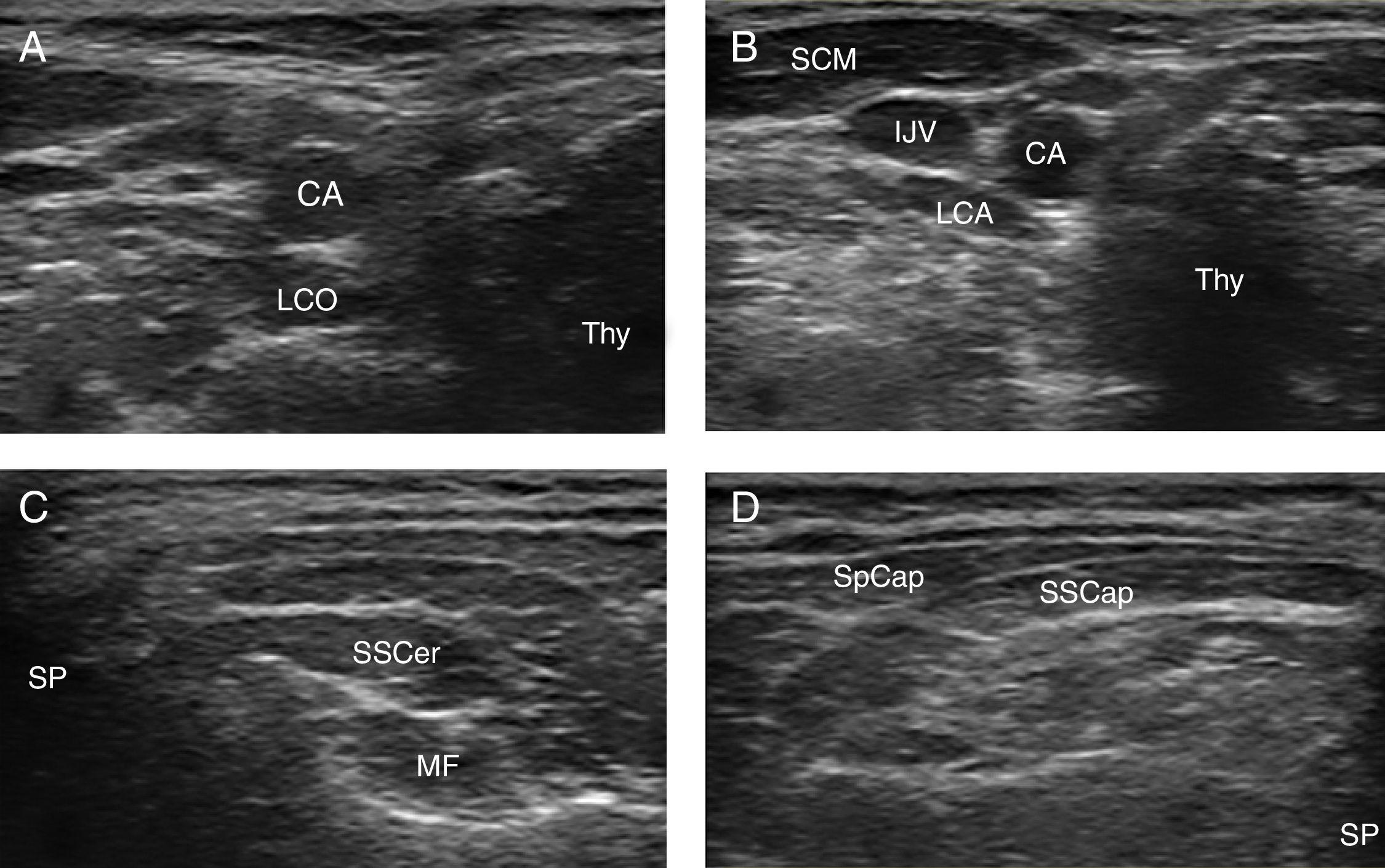 Longus Colli Ultrasound
