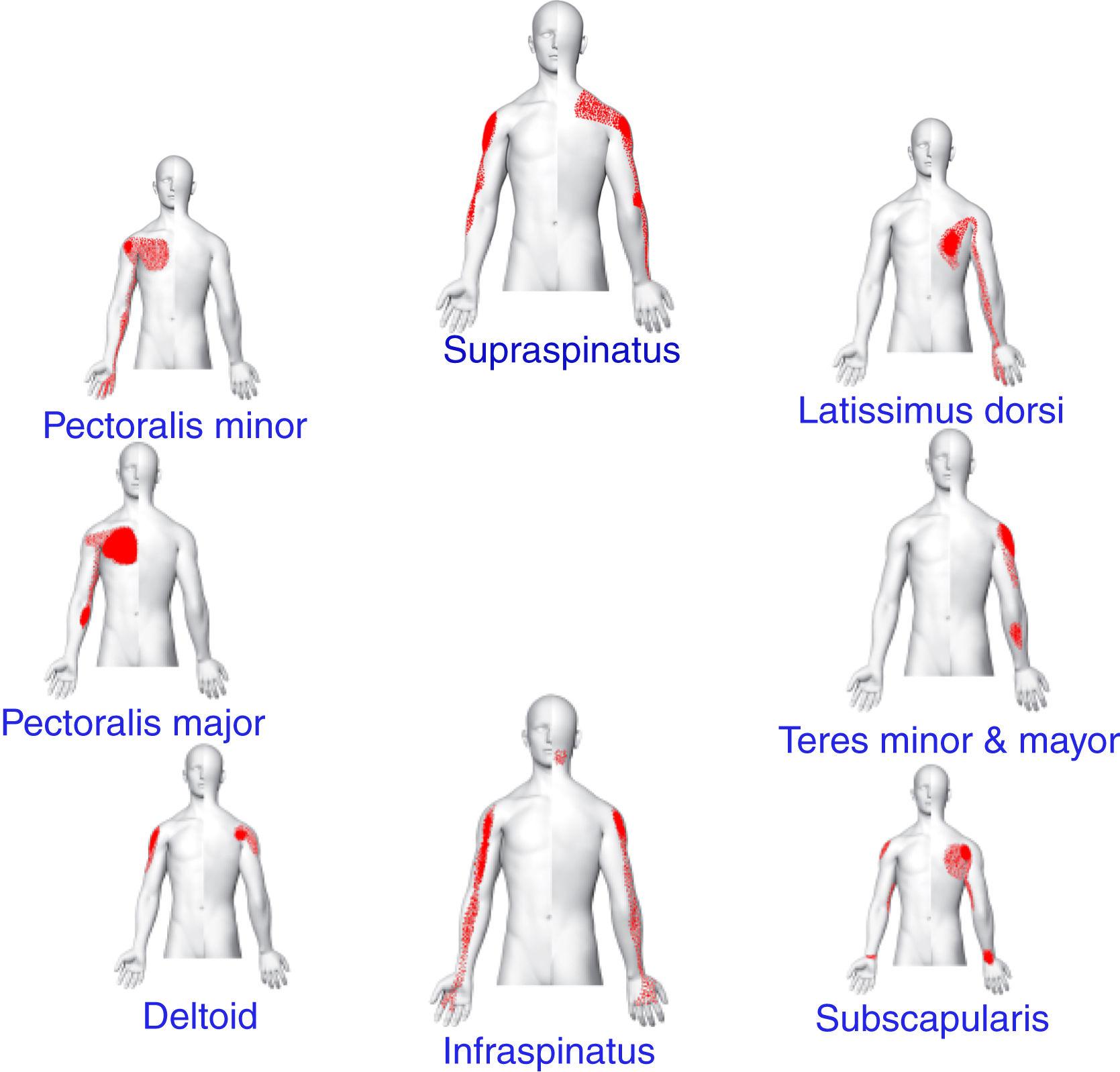 Subscapularis Pain