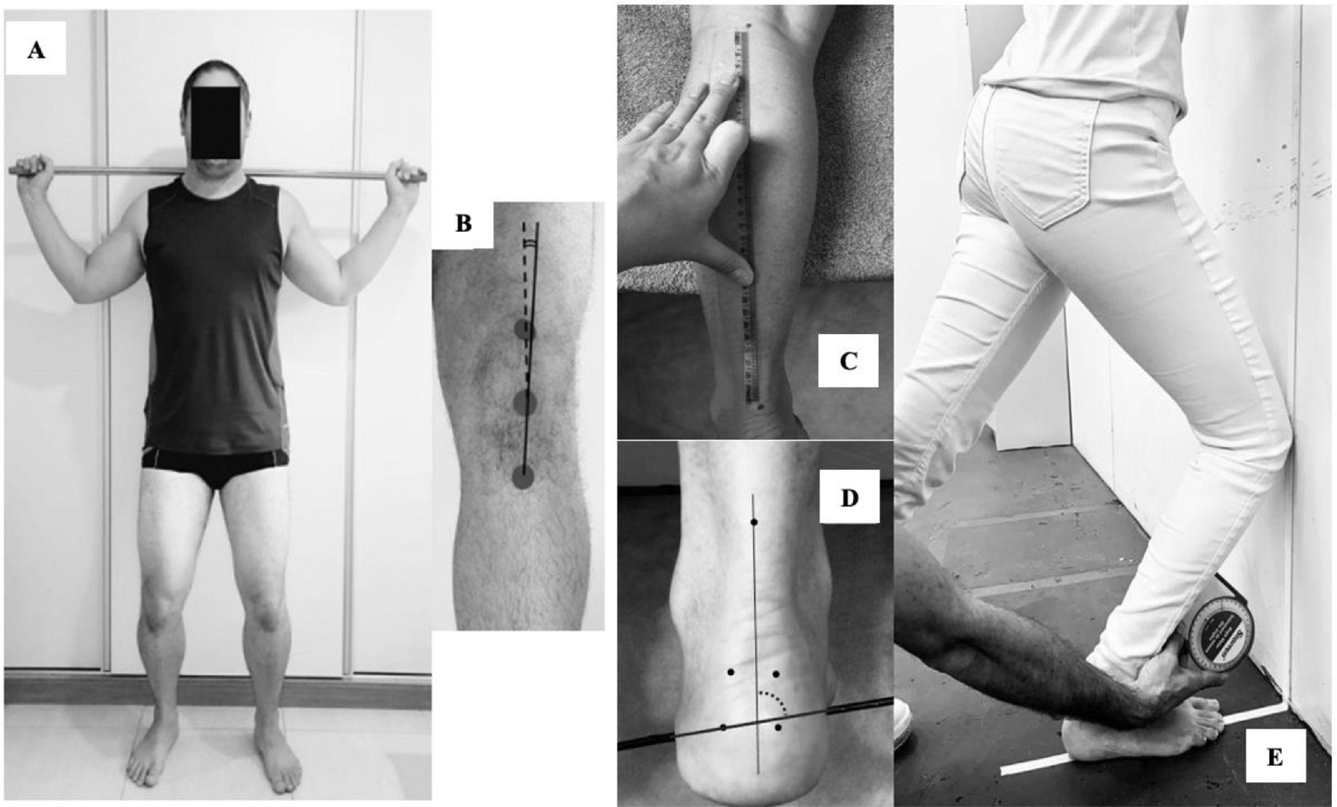 Influence of lower limb torque, range of motion, and foot alignment in ...