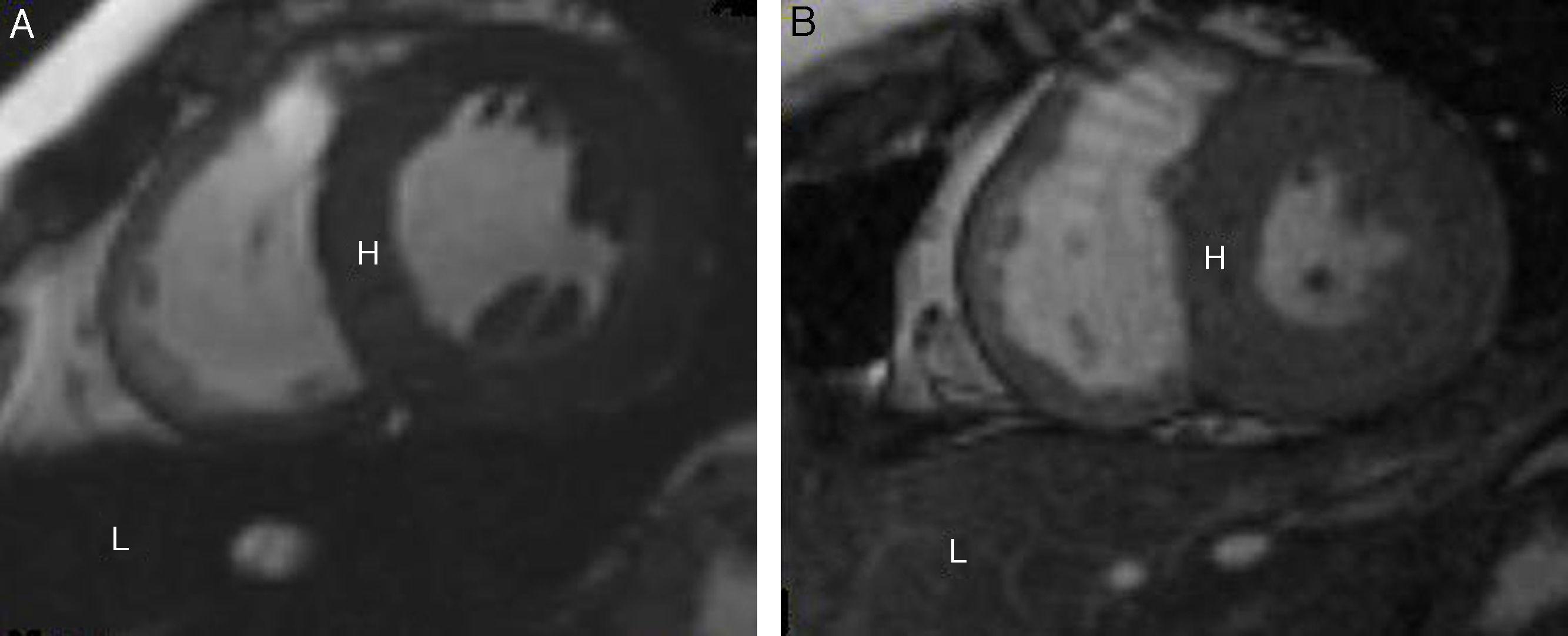 The role of magnetic resonance imaging in the evaluation of ...