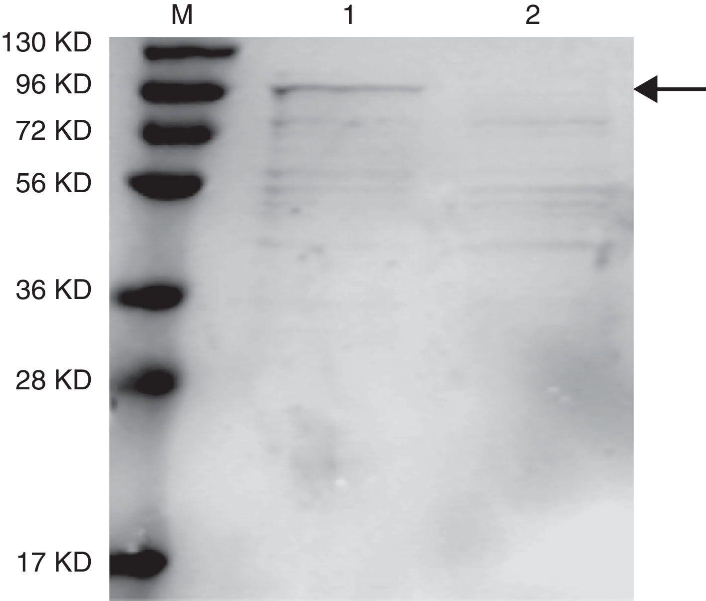 The virulence of Streptococcus pneumoniae partially depends on dprA ...