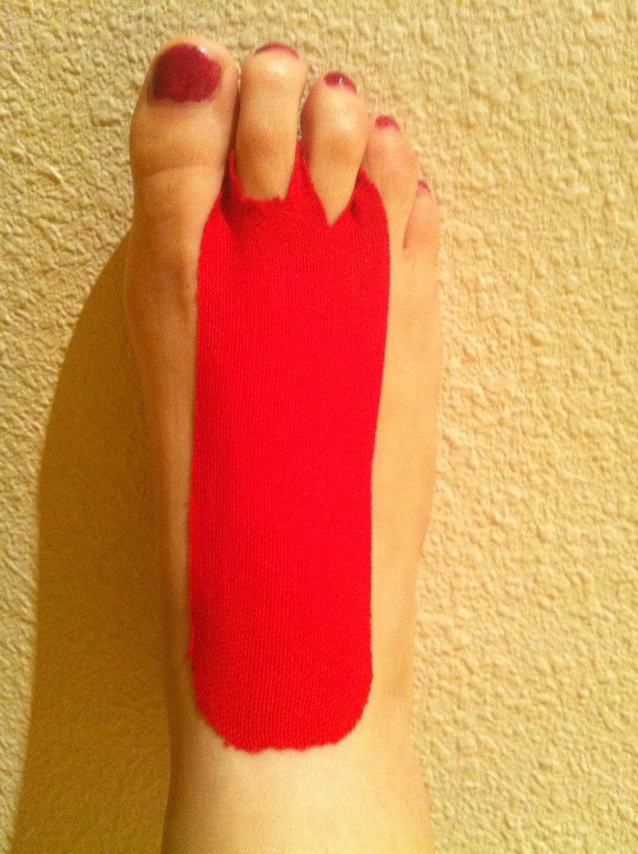 Taping en reumatología | Seminarios de la Fundación Española de ...