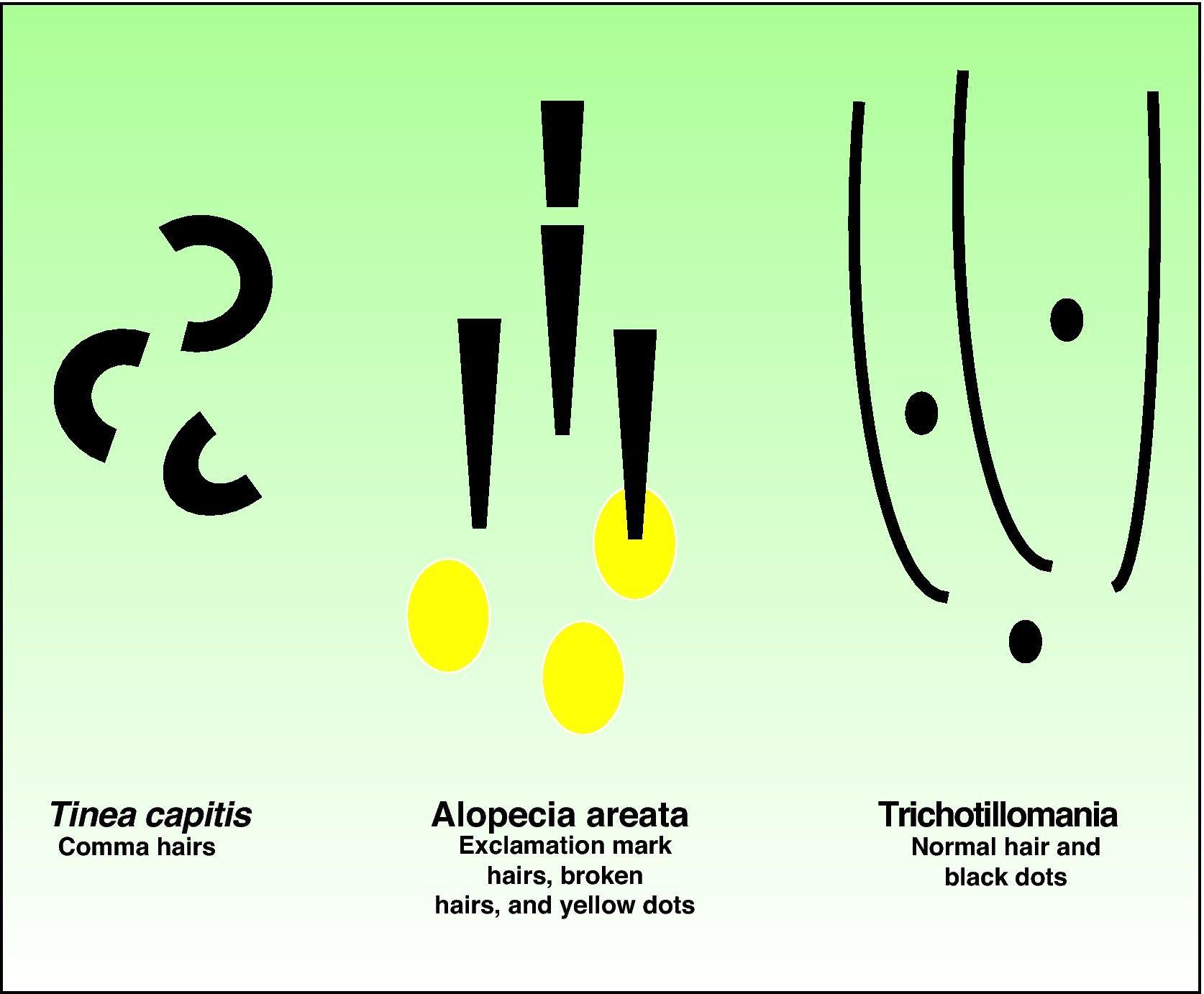Alopecia Areata Exclamation Point Hair