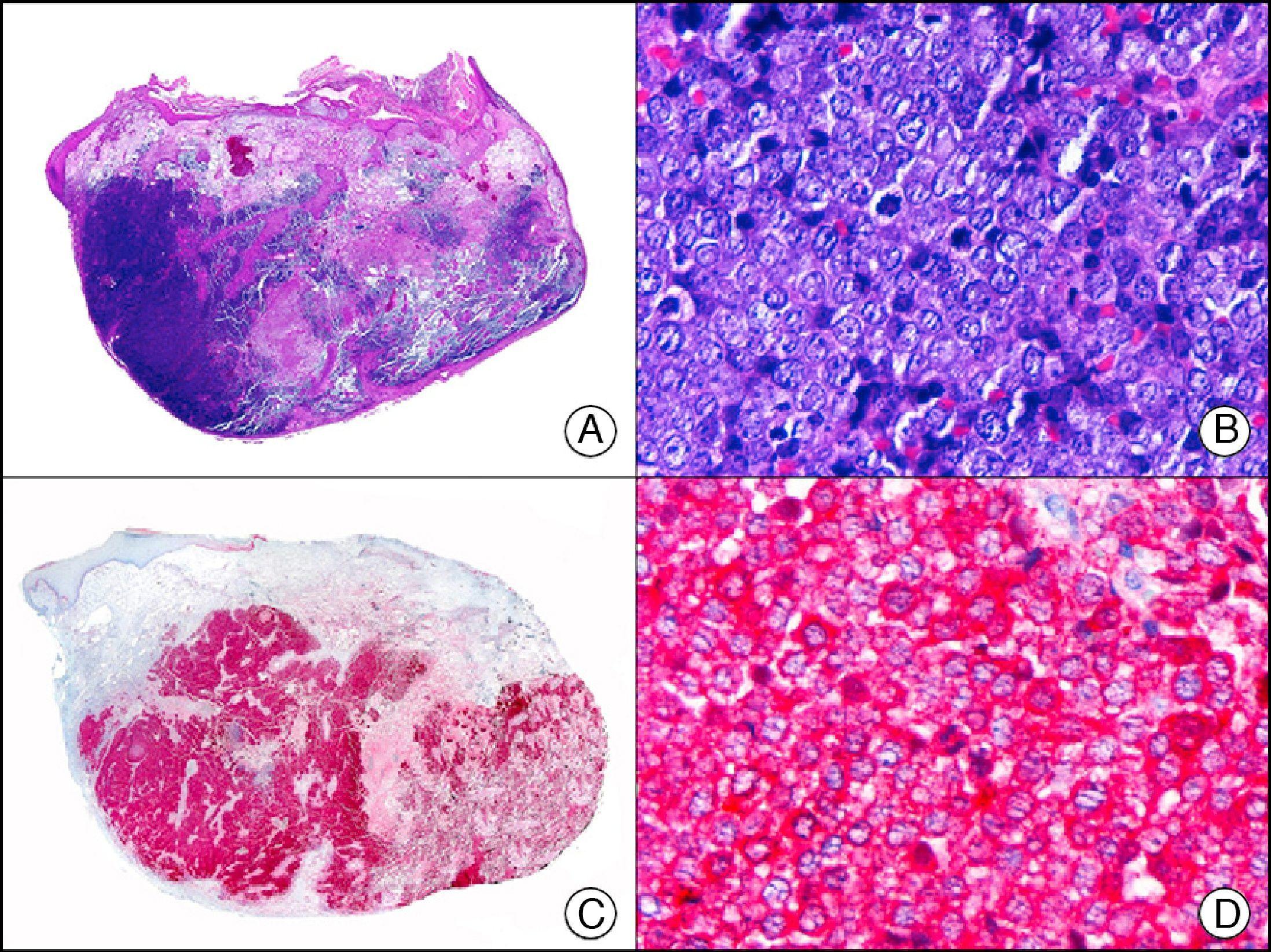Immunohistochemistry in Dermatopathology: A Review of the Most Commonly ...