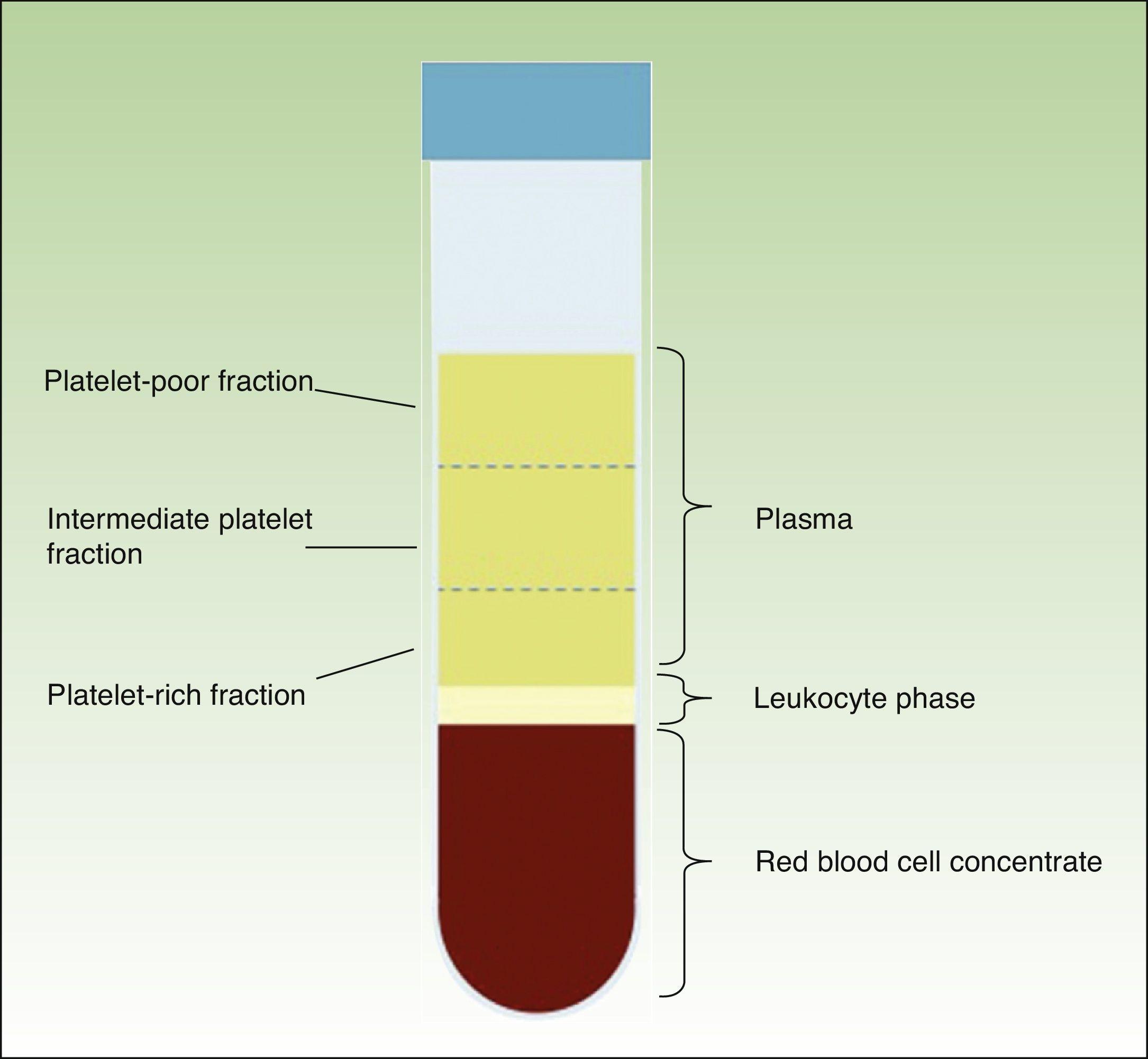 Platelet-Rich Plasma: Applications in Dermatology | Actas Dermo ...