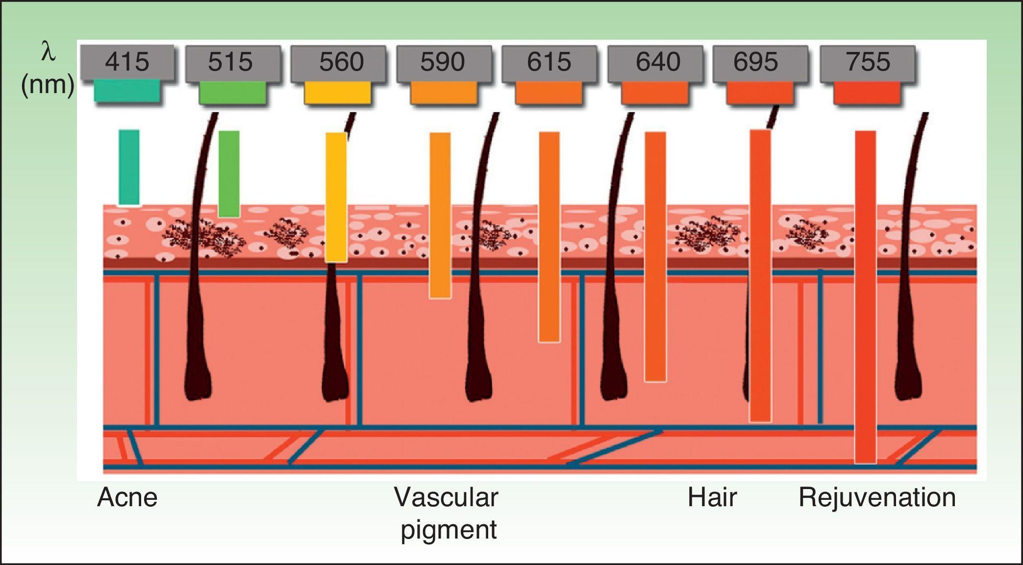Current Indications and New Applications of Intense Pulsed Light ...