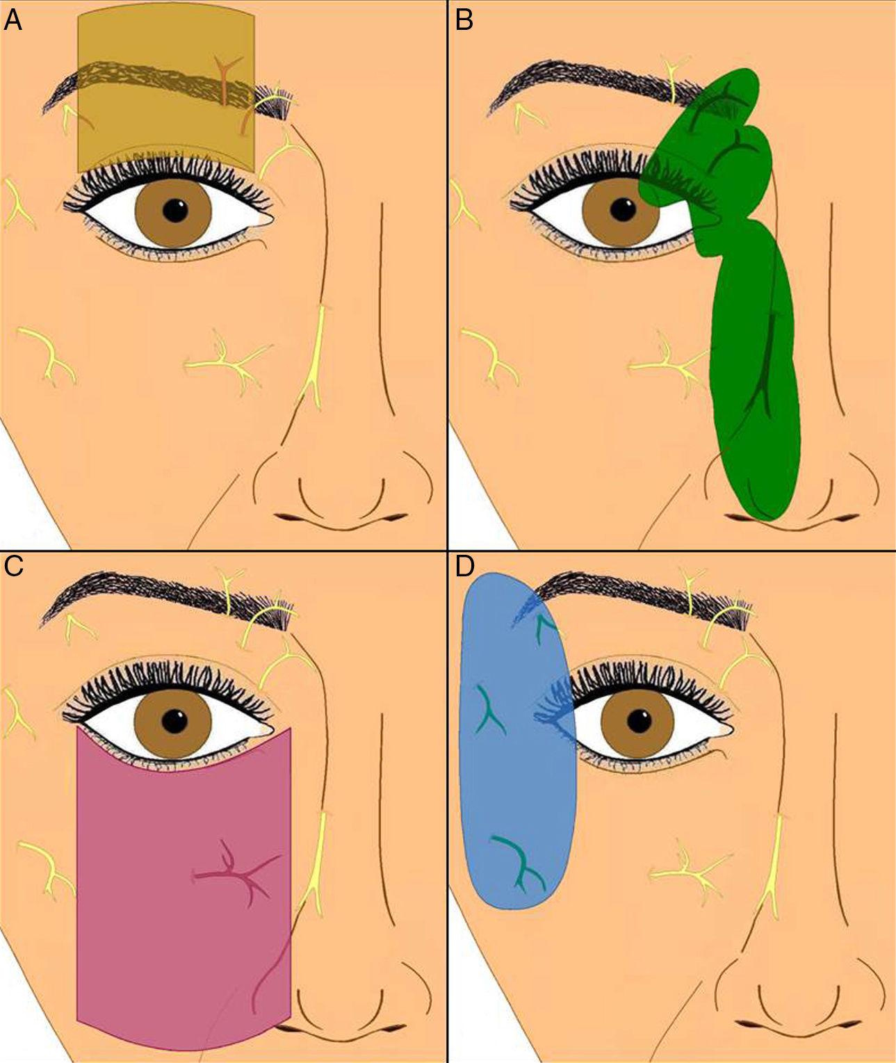 Cpt For Infraorbital Nerve Block