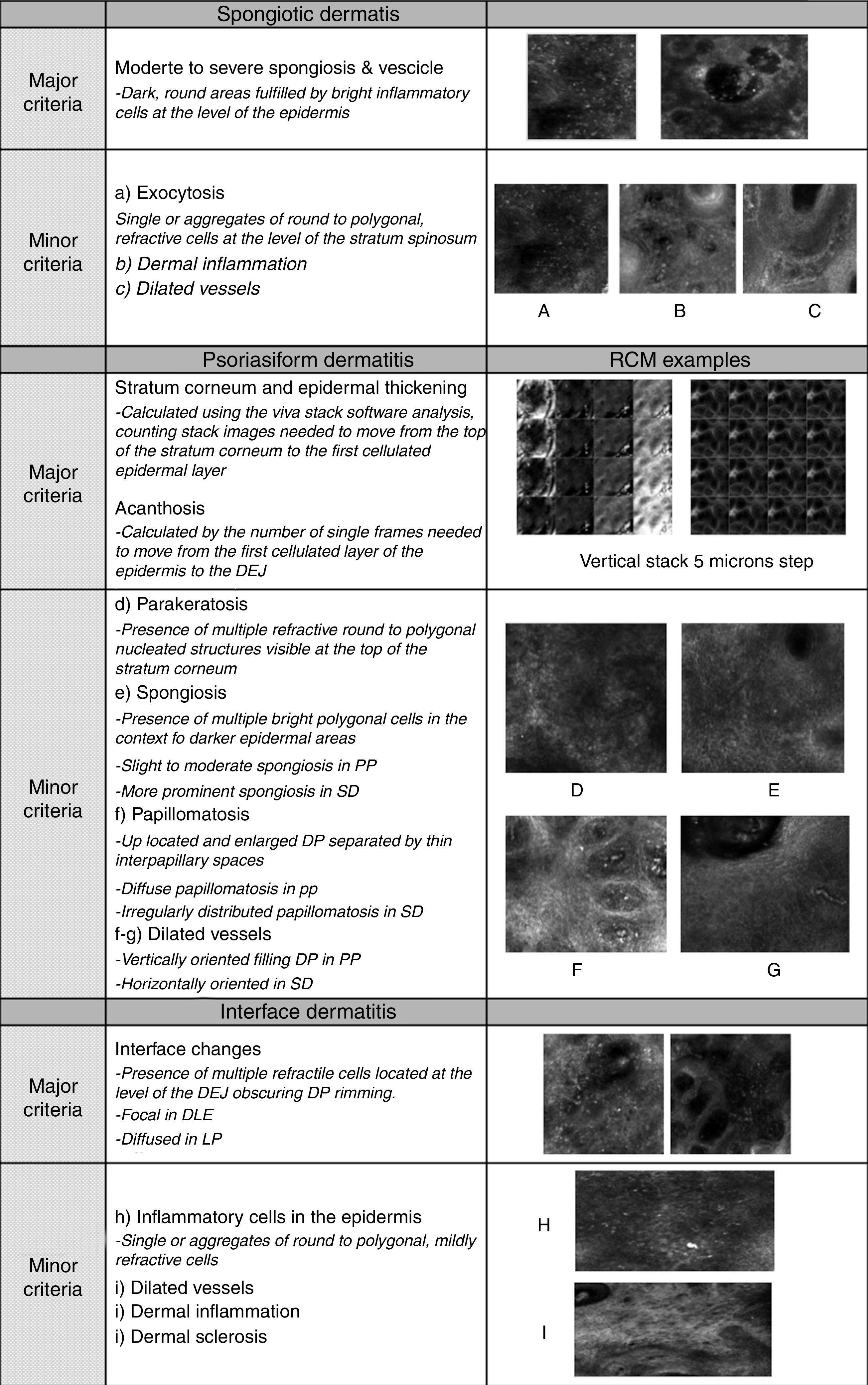 Reflectance Confocal Microscopy for Inflammatory Skin Diseases | Actas ...