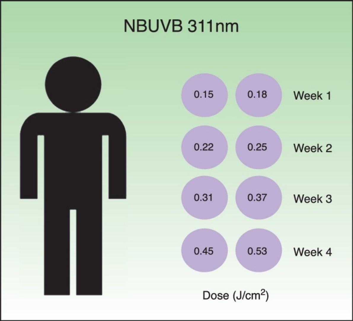 Successful short desensitization treatment protocol with narrowband UVB ...