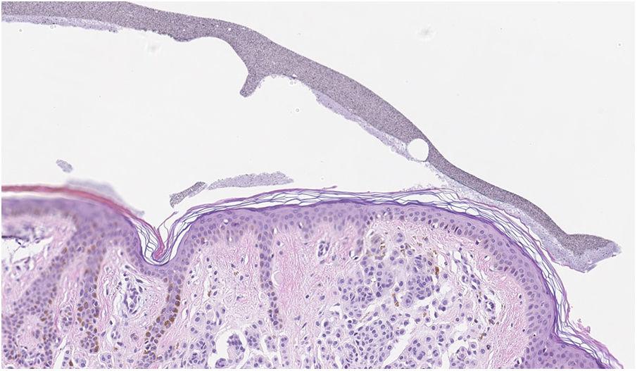 Derm Dotting: A New Technique That Improves Diagnostic Precision in the ...