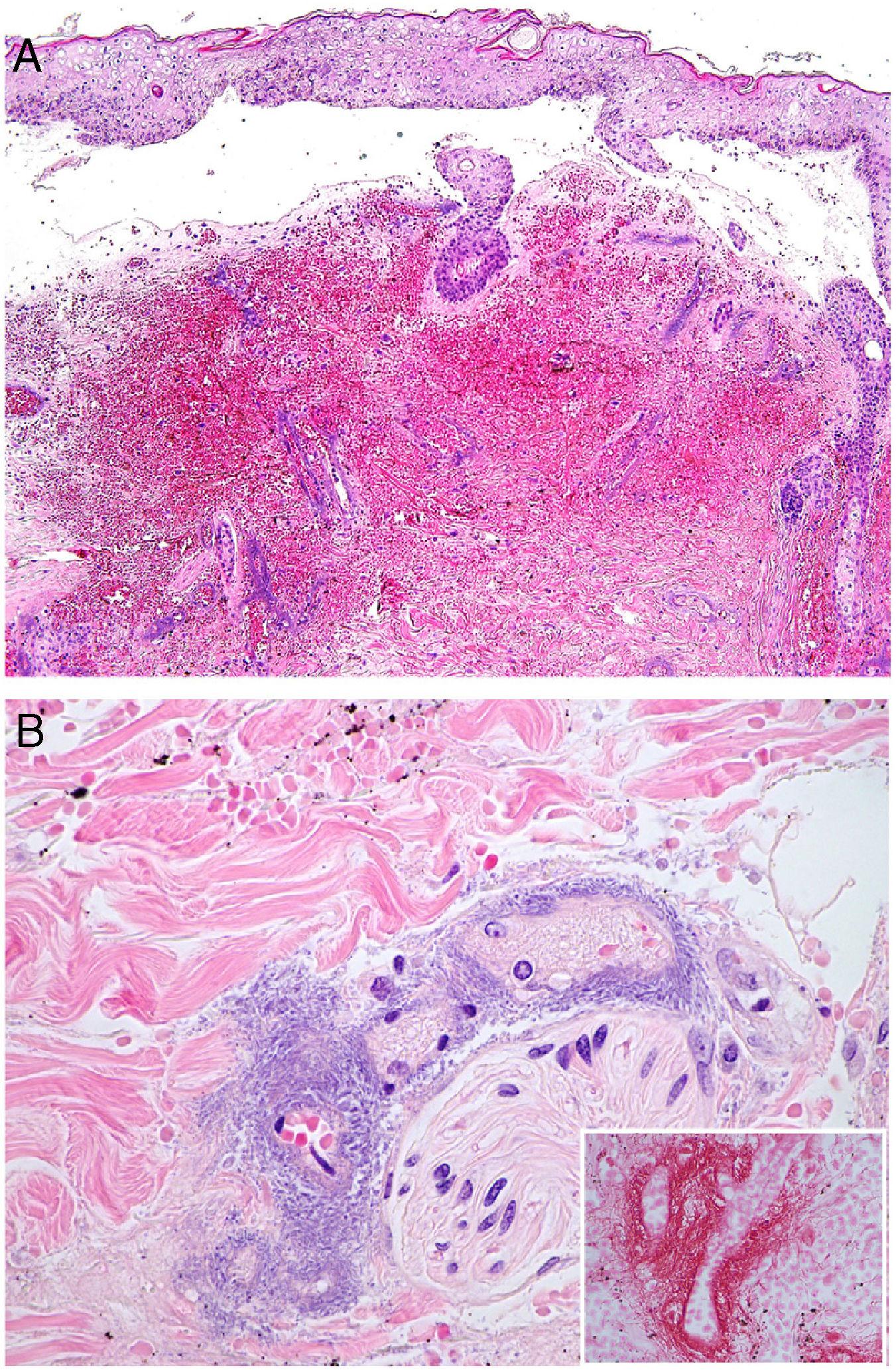 Clinical and Histopathologic Characteristics of the Main Causes of ...