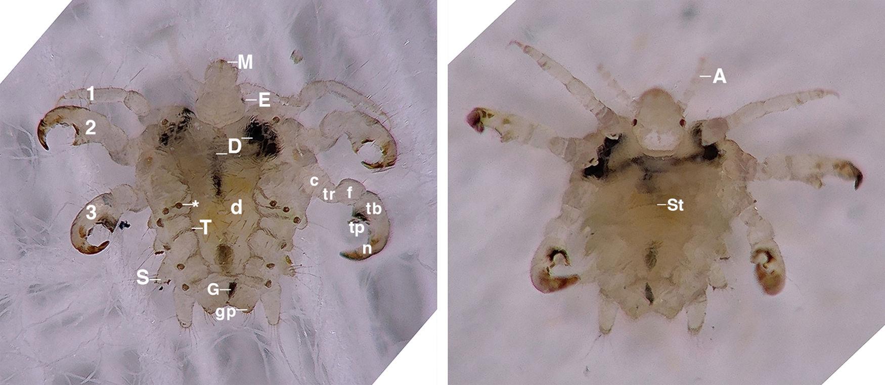 Pthirus pubis Under a Digital Dermoscope: Anatomic Description | Actas ...