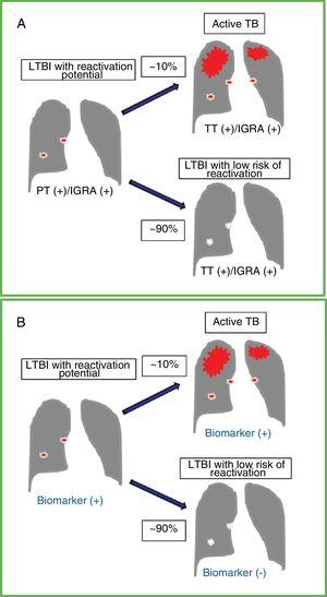 New research strategies in latent tuberculosis infection | Archivos de ...