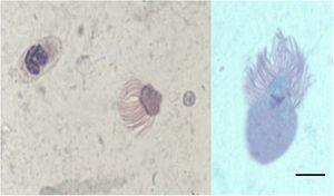 Lophomonas or Ciliated Epithelial Cells? | Archivos de Bronconeumología