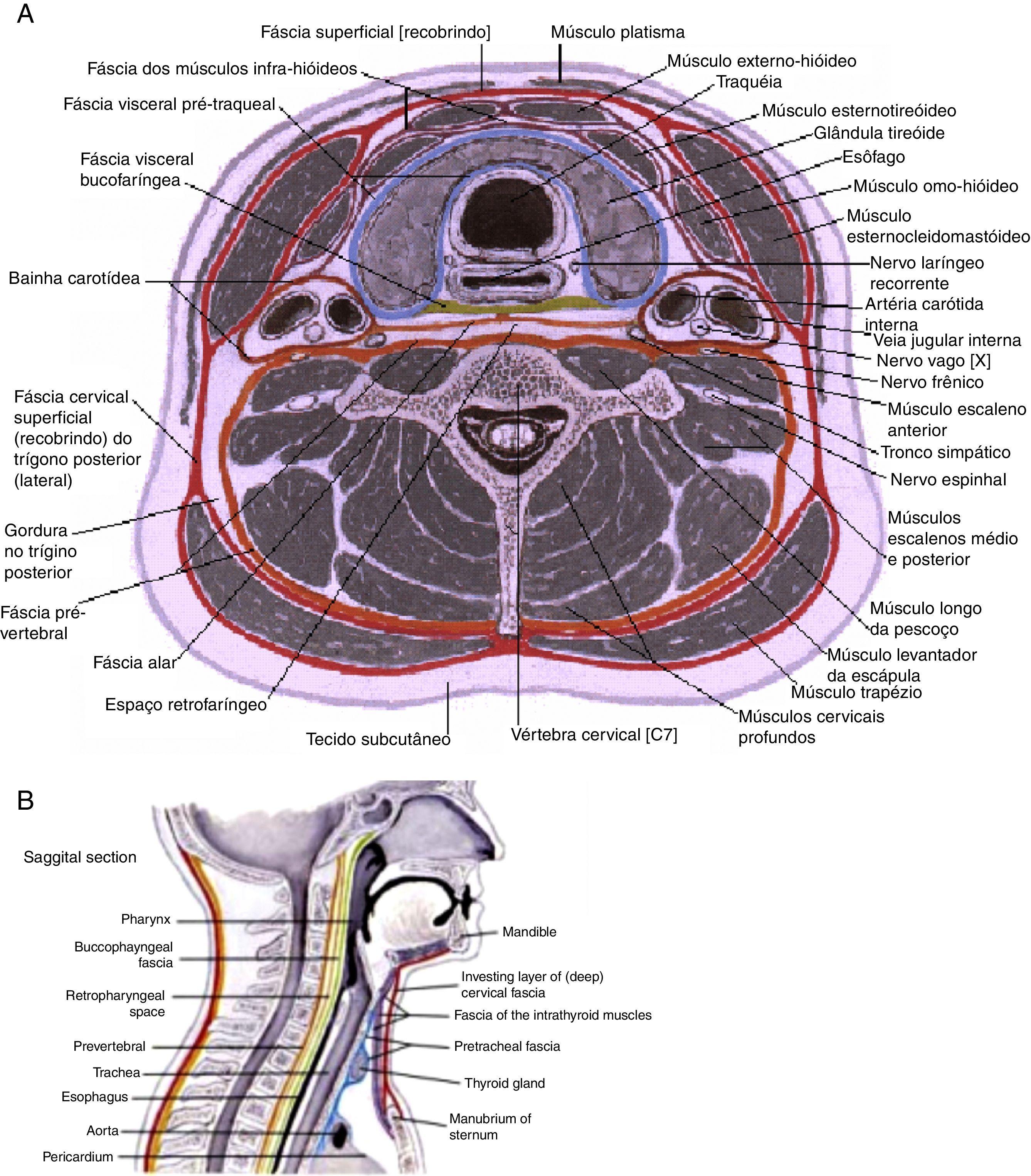 Abcesso cervical profundo numa doente diabética | Revista Portuguesa de ...