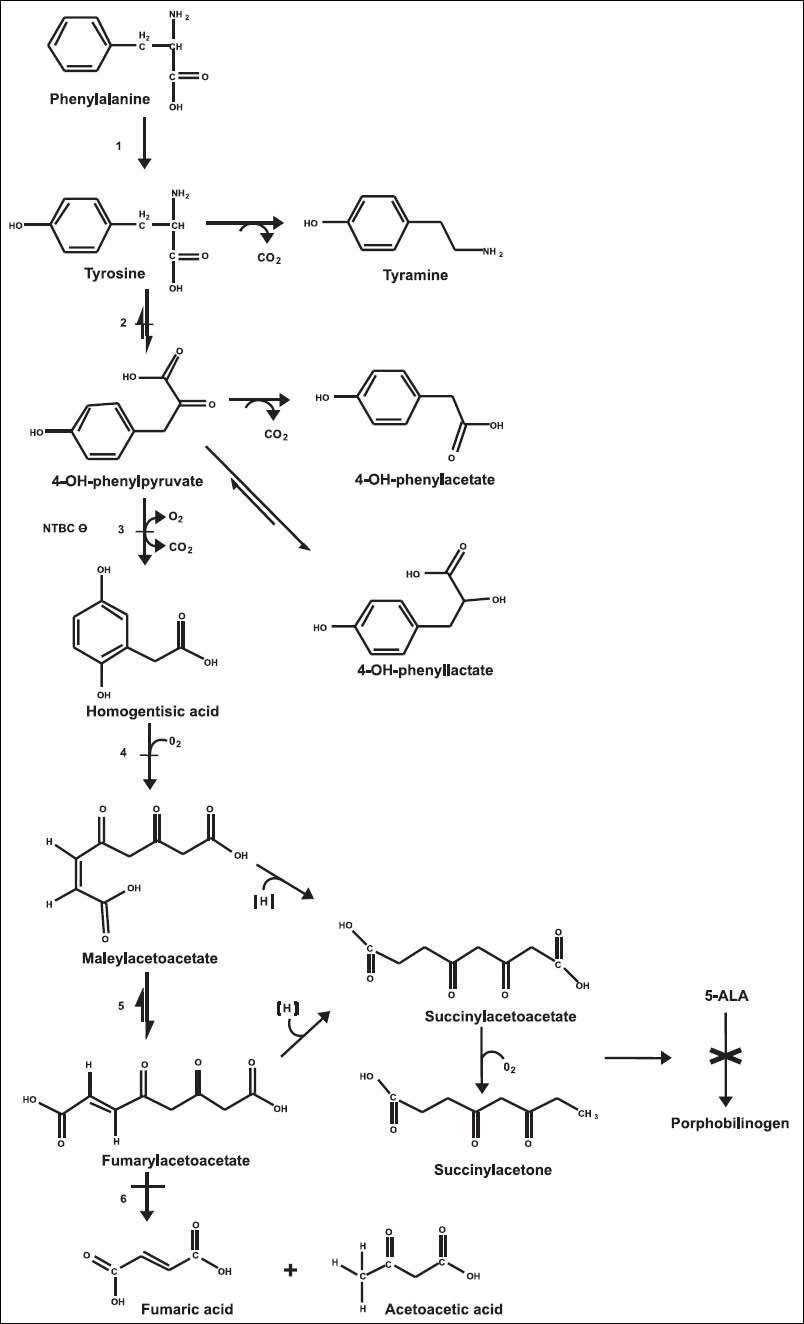 Tyrosinemia type I: clinical and biochemical analysis of patients in ...