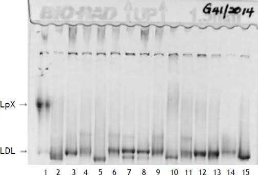 Severe hypercholesterolemia mediated by lipoprotein X in a patient with ...