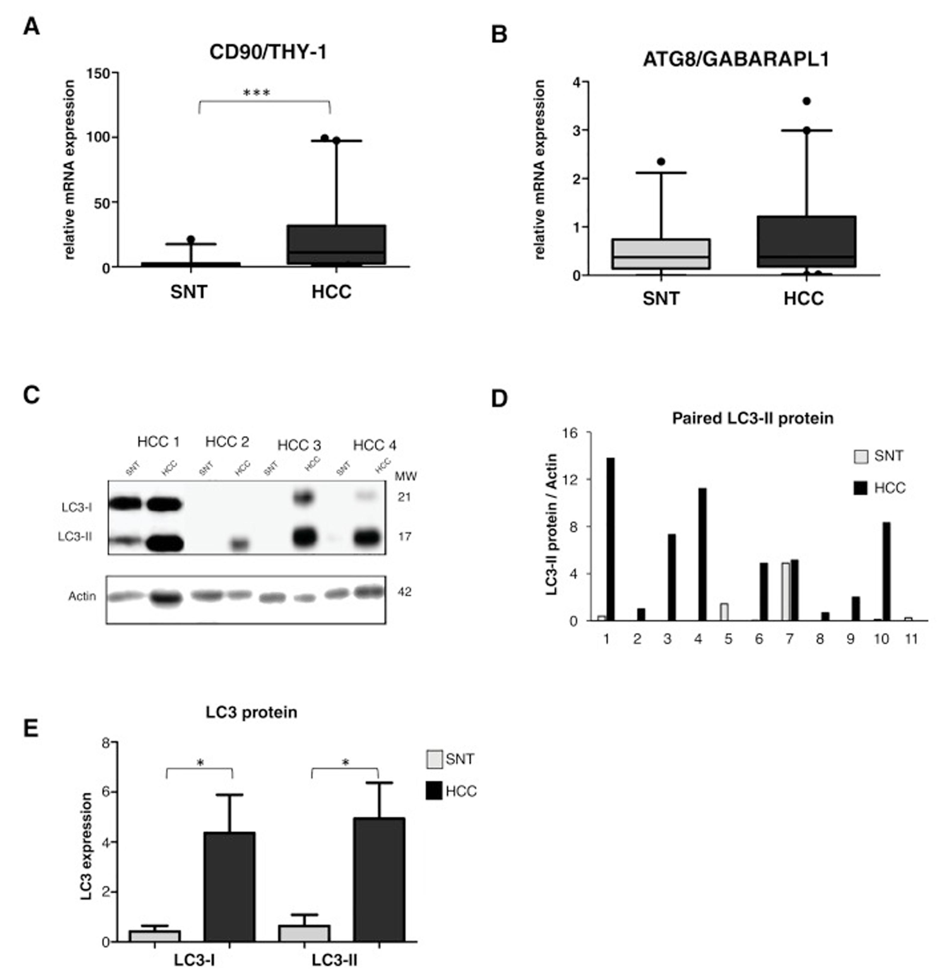 Differential capacity of CD90+ cells in autophagy activation following ...