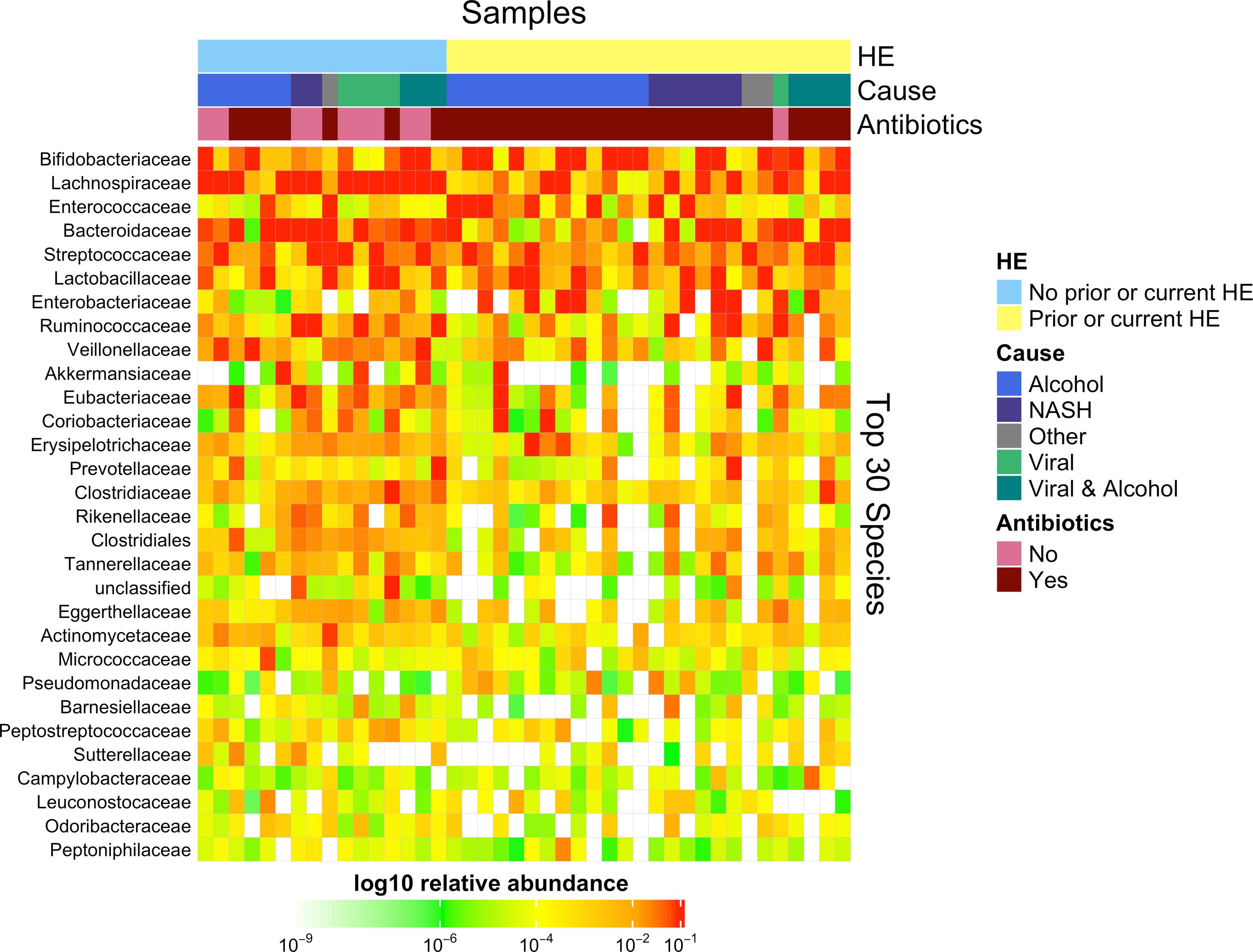 Deep stool microbiome analysis in cirrhosis reveals an association ...