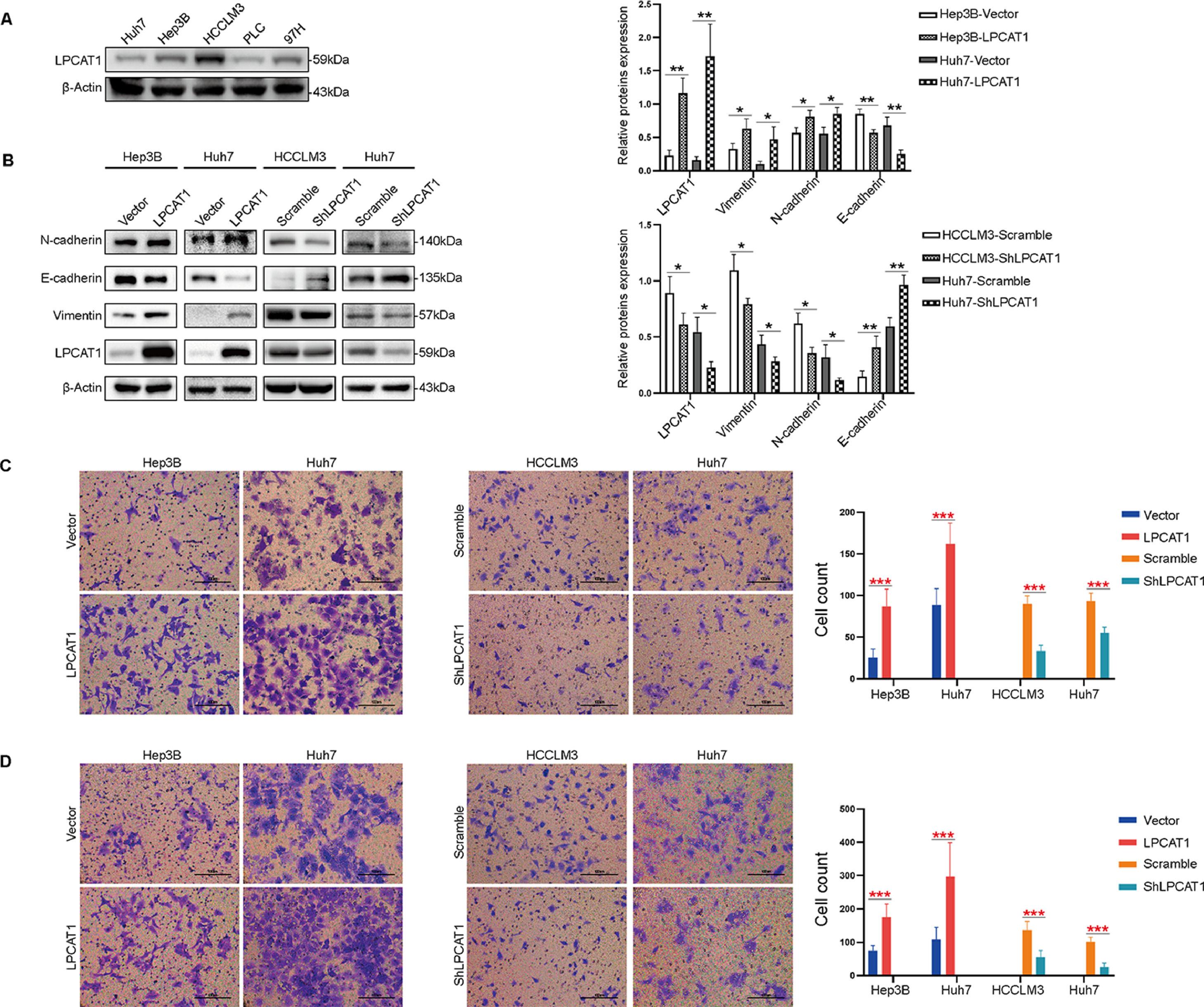 Lysophosphatidylcholine acyltransferase 1 promotes epithelial ...
