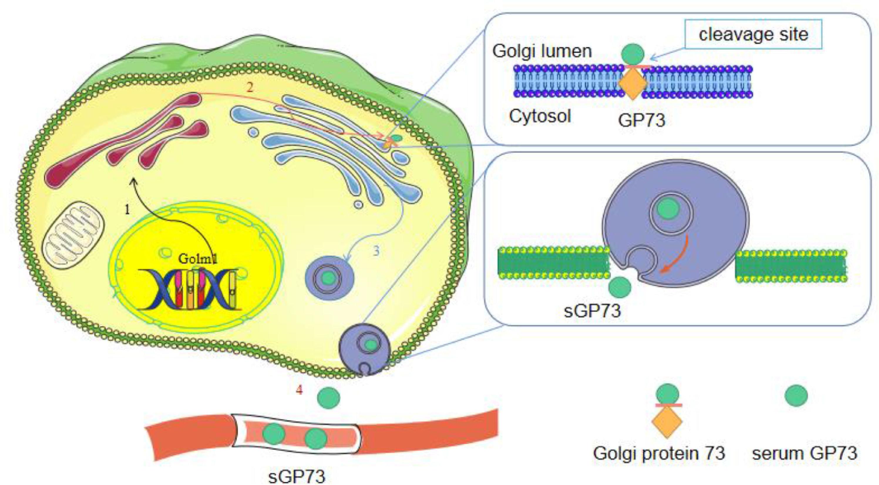 Possible roles of Golgi protein-73 in liver diseases | Annals of Hepatology
